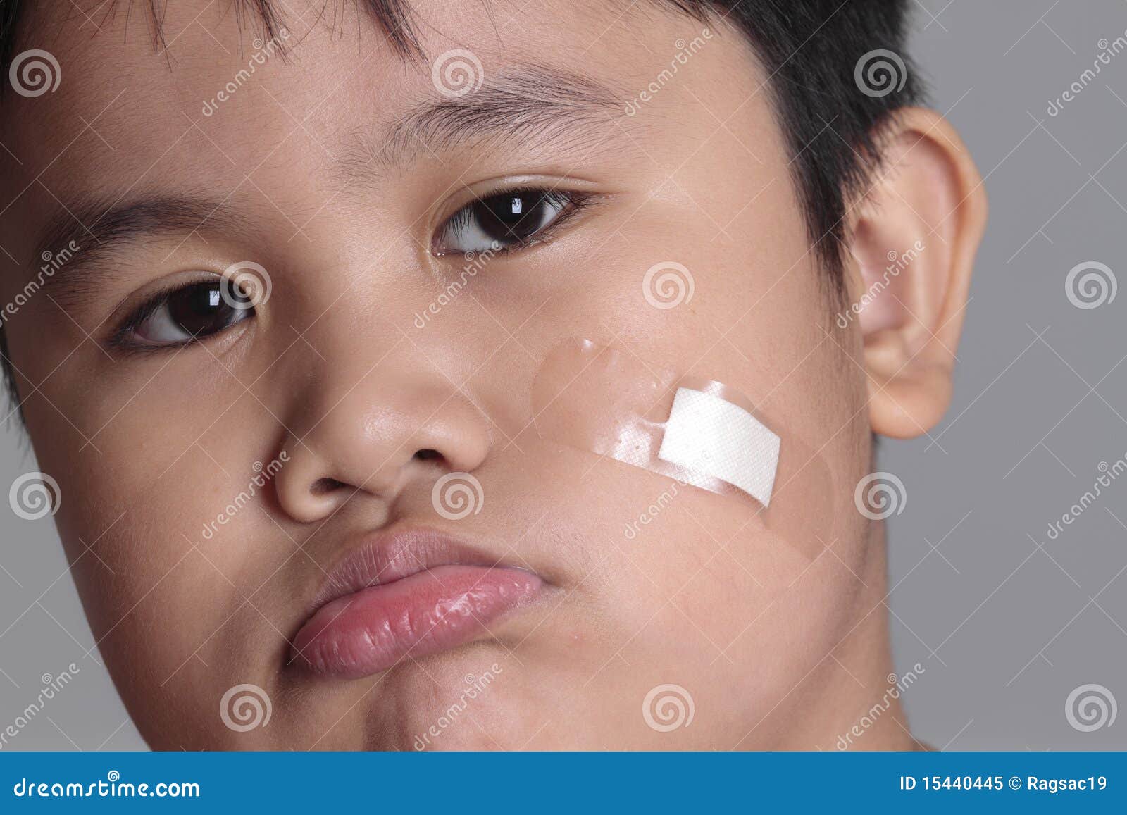 Muchacho lastimado imagen de archivo. Imagen de herido - 15440445