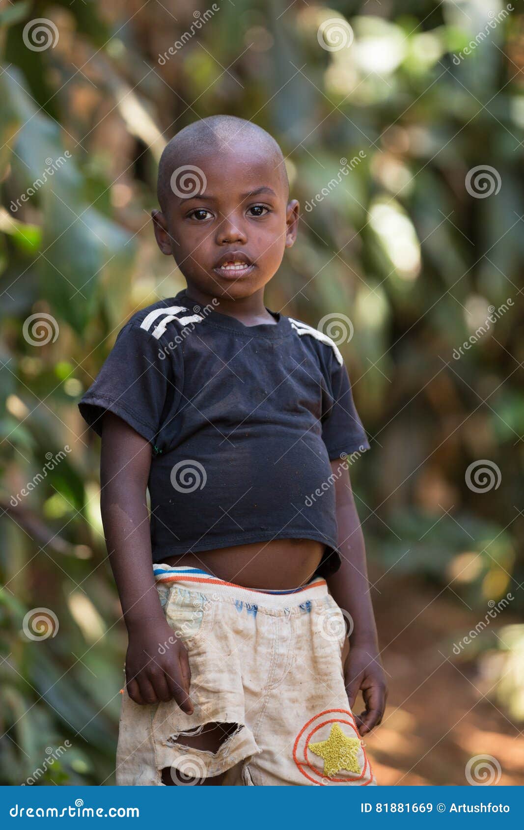 Muchacho Malgache En Ropa Rasgada Imagen de archivo editorial - Imagen ...