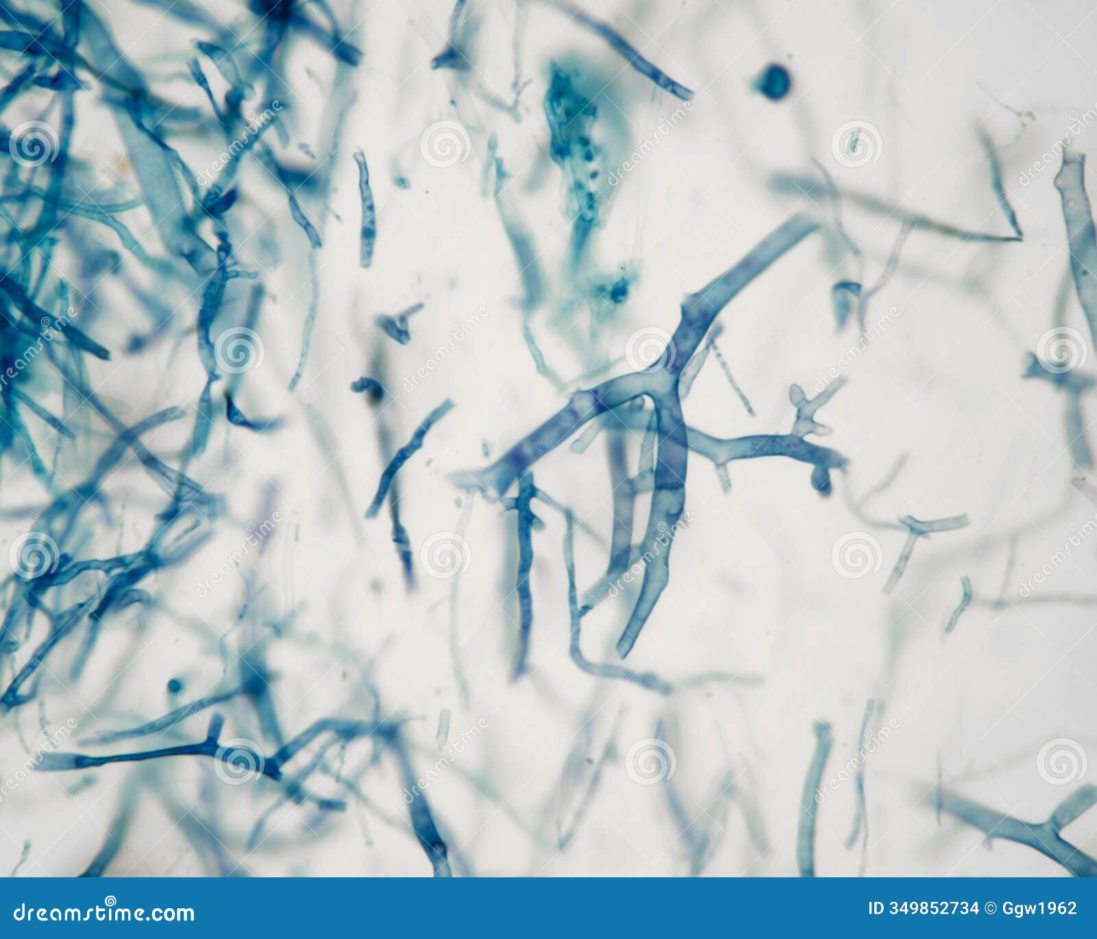 Mucor Under Microscope