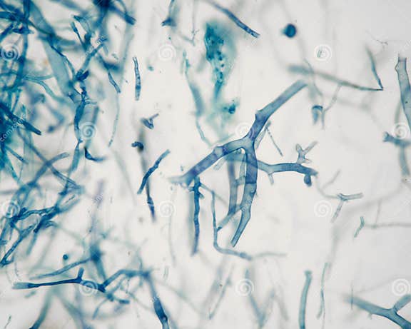 Mucor mucedo mycelium stock photo. Image of plant, health - 349852734