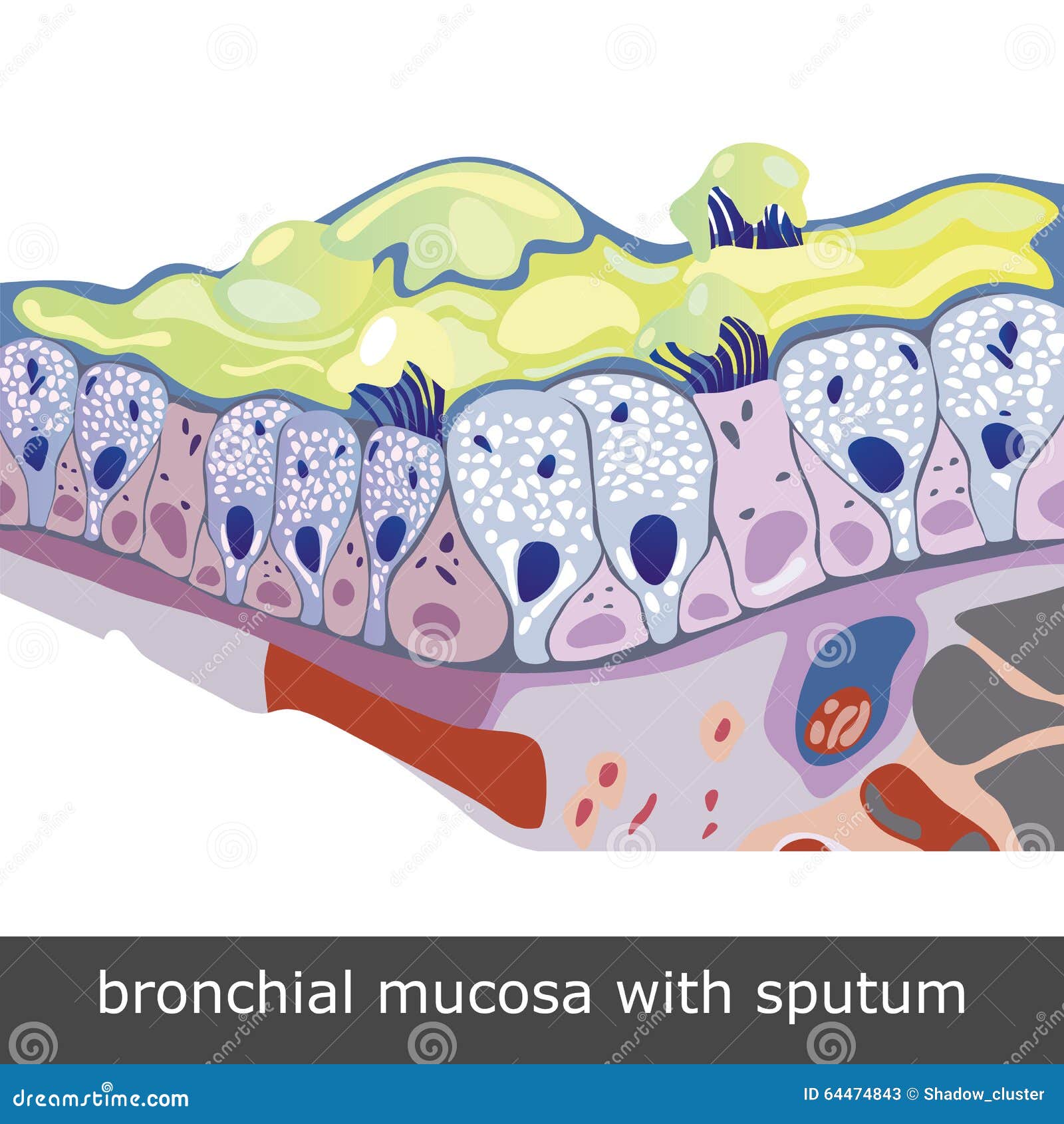 Mucosa Bronchiale Con Espettorato Illustrazione Vettoriale ...