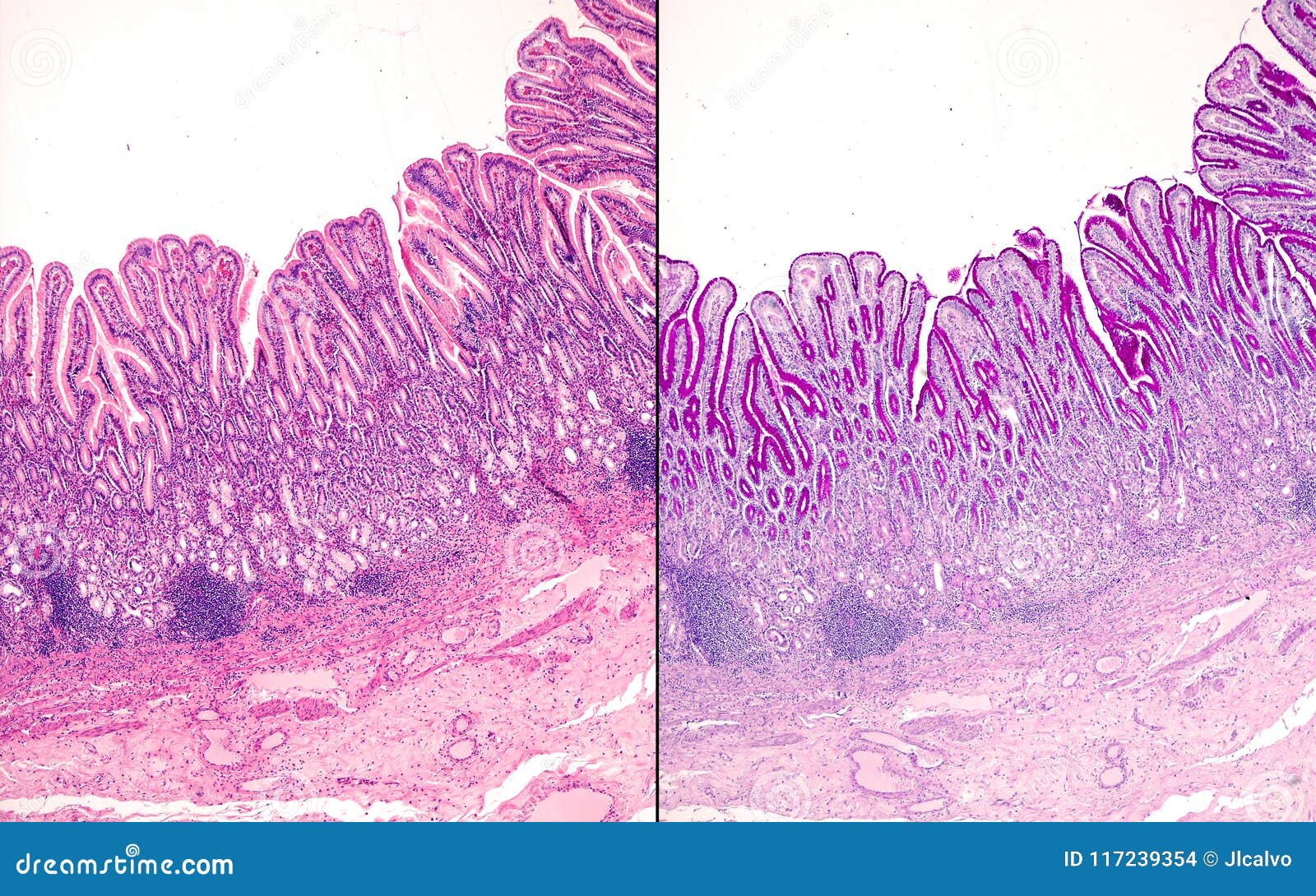 195 Pylorique Photos libres de droits et gratuites de Dreamstime