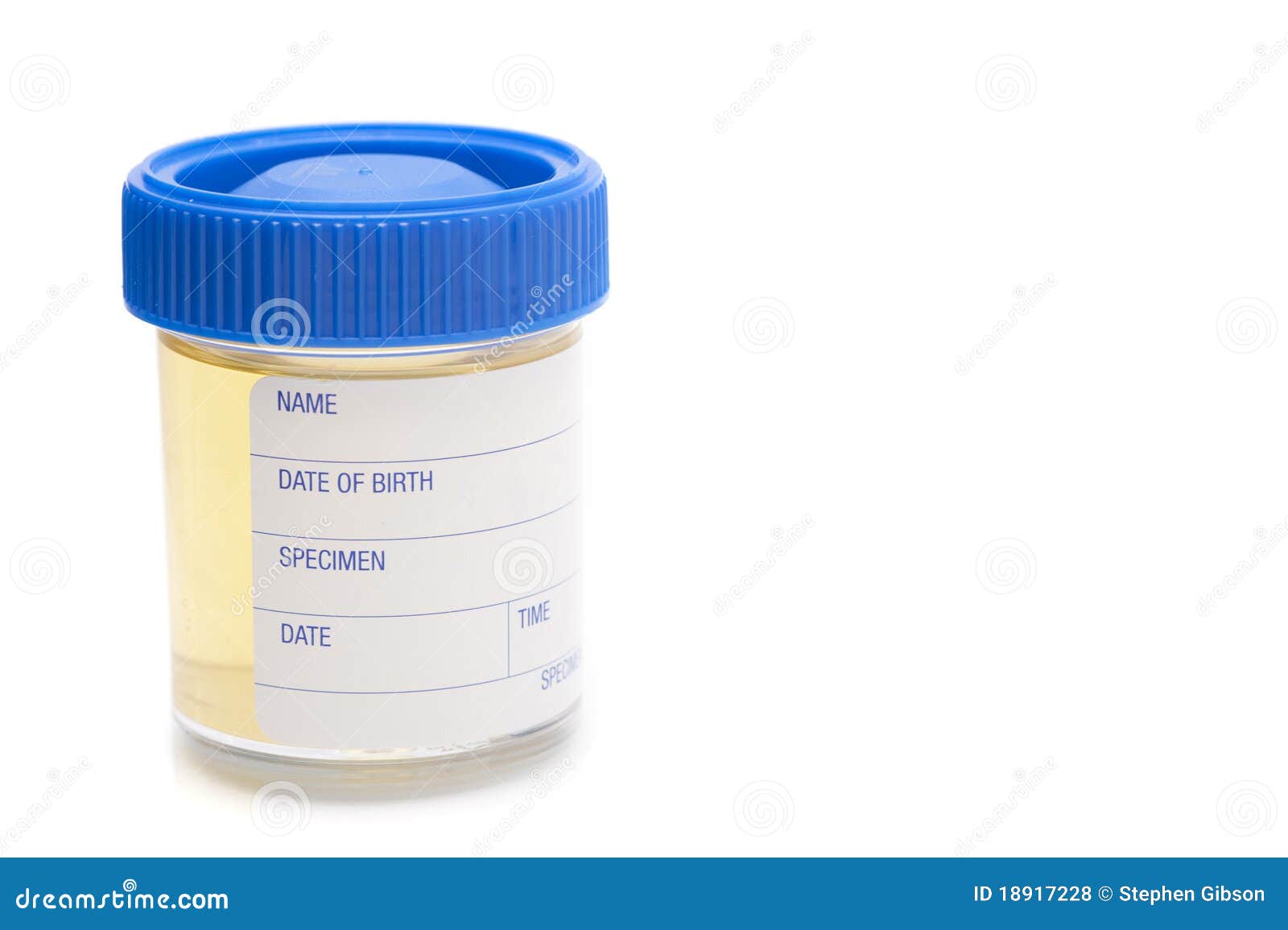 Muestra de orina foto de archivo. Imagen de médico, orina - 18917228