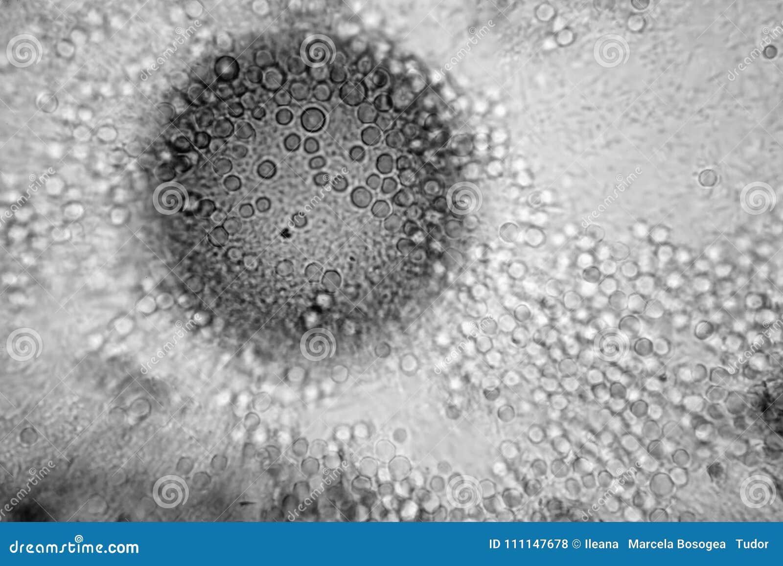 Muffa al microscopio fotografia stock. Immagine di fungoso - 111147678