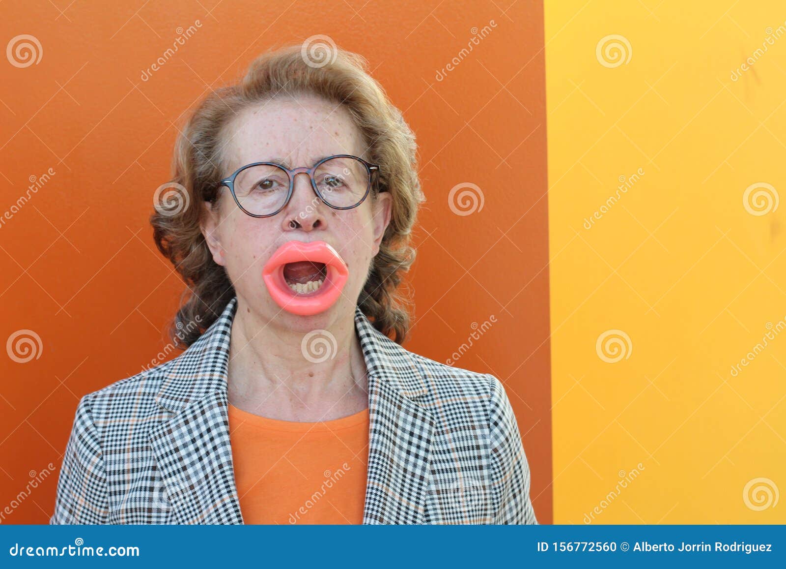 Mujer Con Botox En Los Labios Foto de archivo - Imagen de médico ...