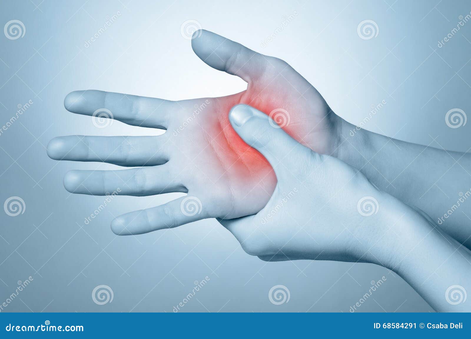 Mujer con dolor de la mano imagen de archivo. Imagen de terapia - 68584291