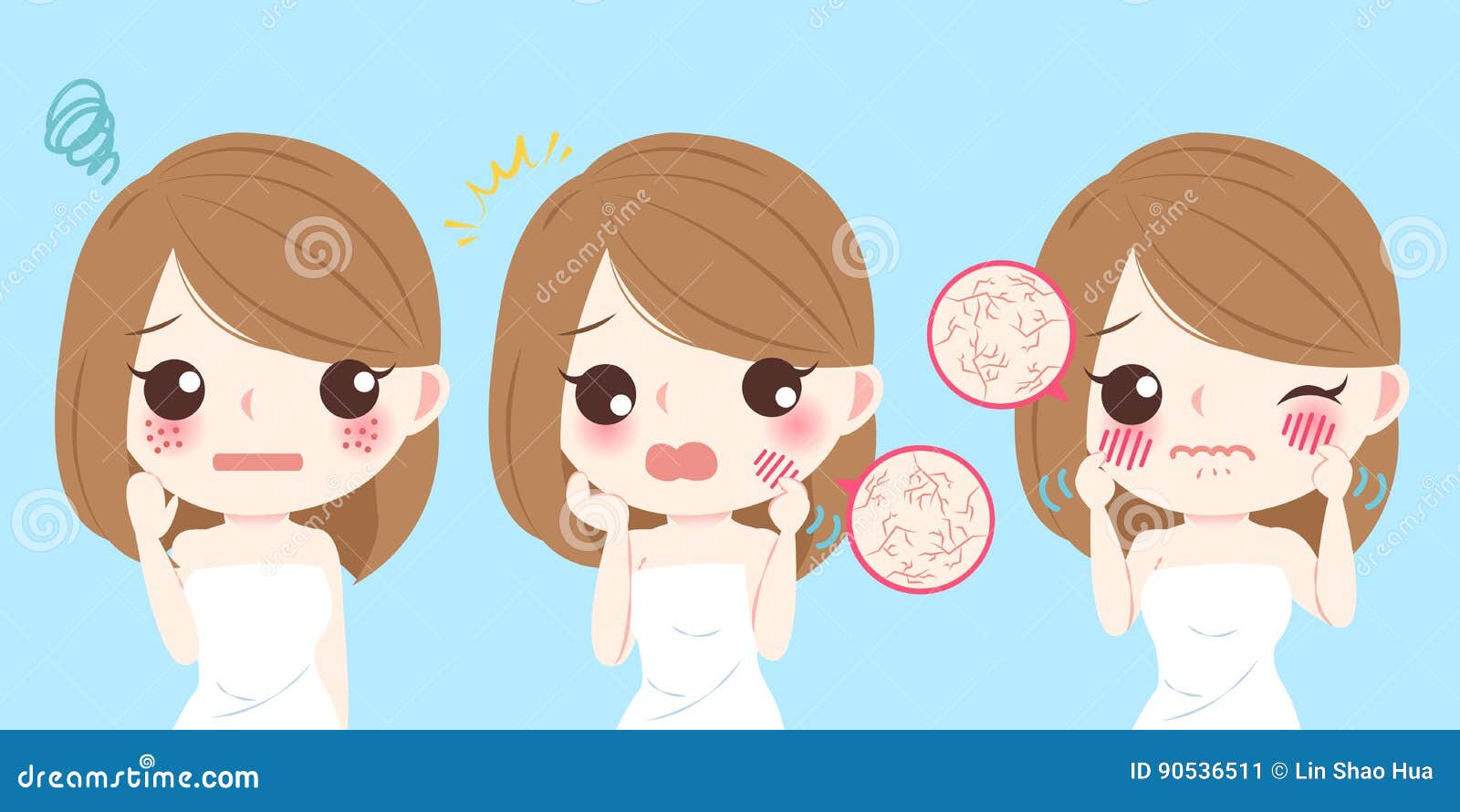 Mujer con la piel seca ilustración del vector. Ilustración de ...