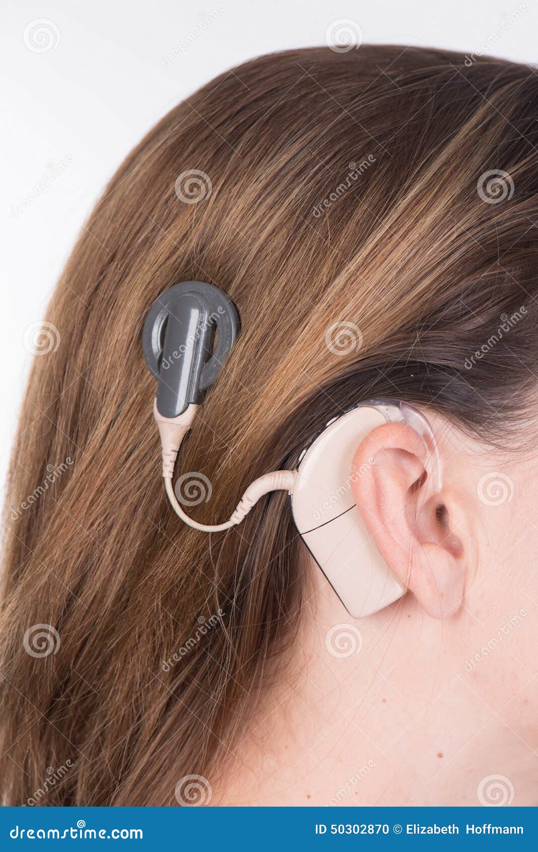 Mujer Joven Con El Implante Coclear Foto de archivo - Imagen de ...