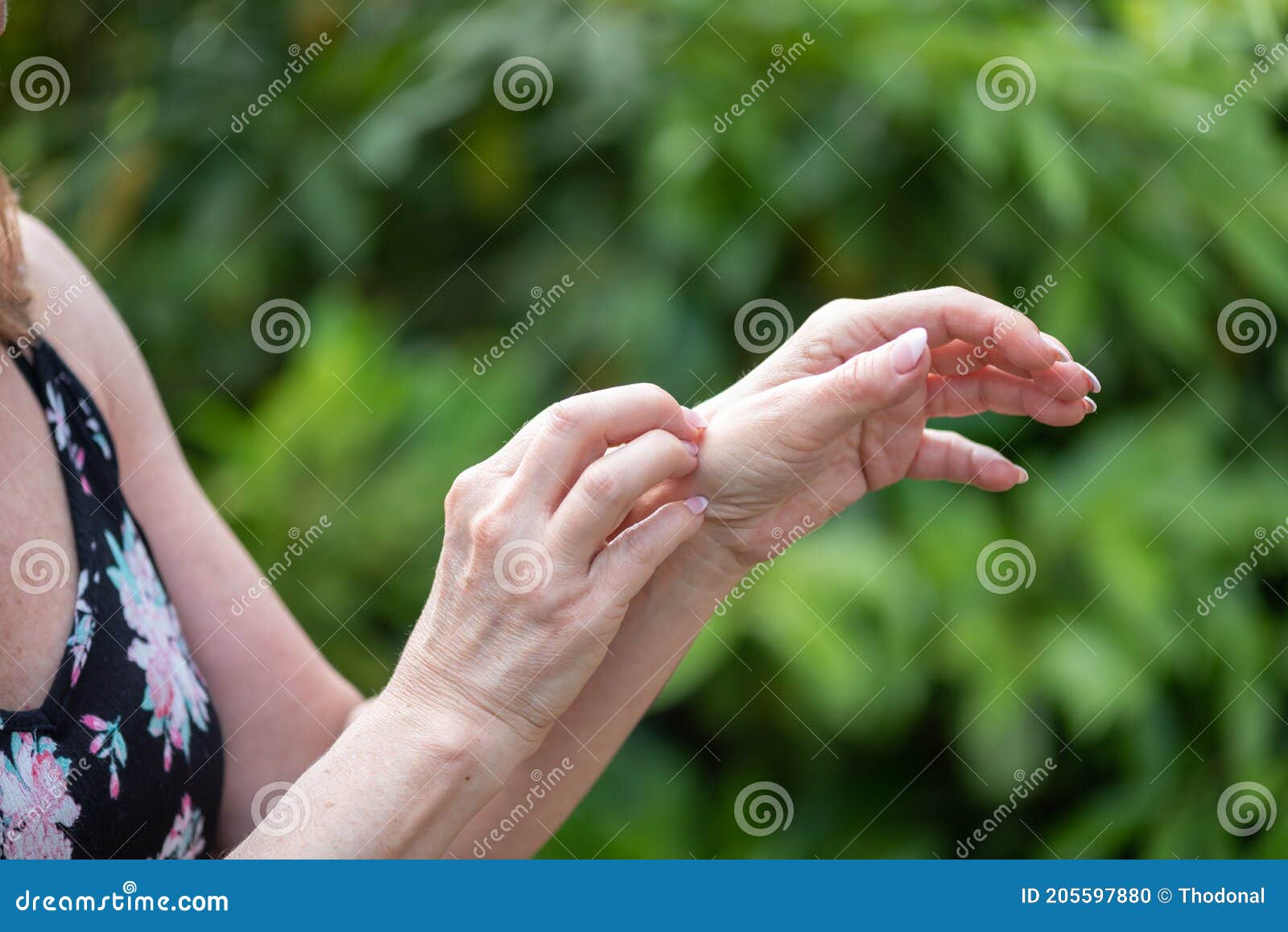 Mujer rascando su mano foto de archivo. Imagen de tratamiento - 205597880