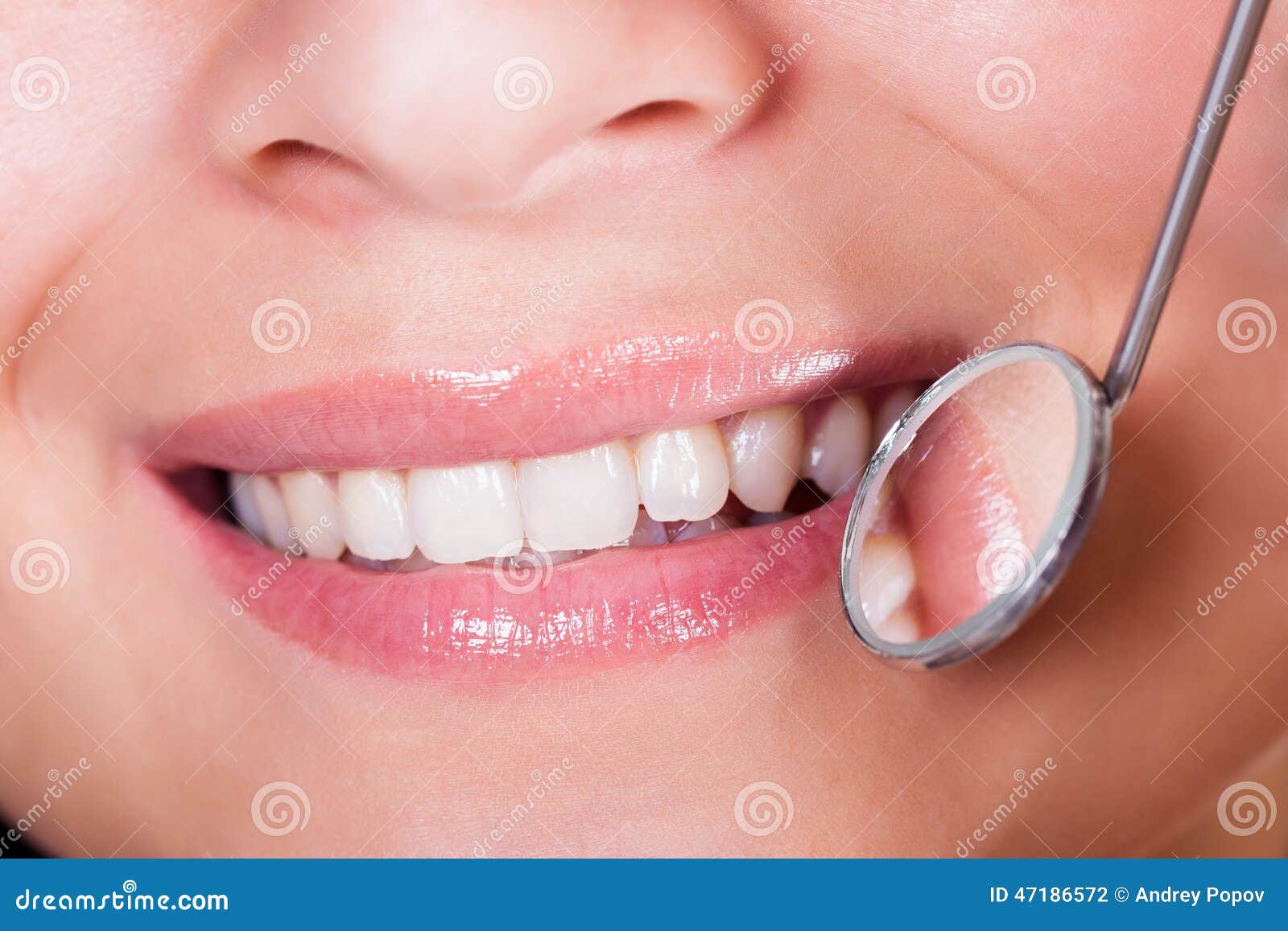 Mujer Sonriente Con Los Dientes Perfectos Foto de archivo - Imagen de ...
