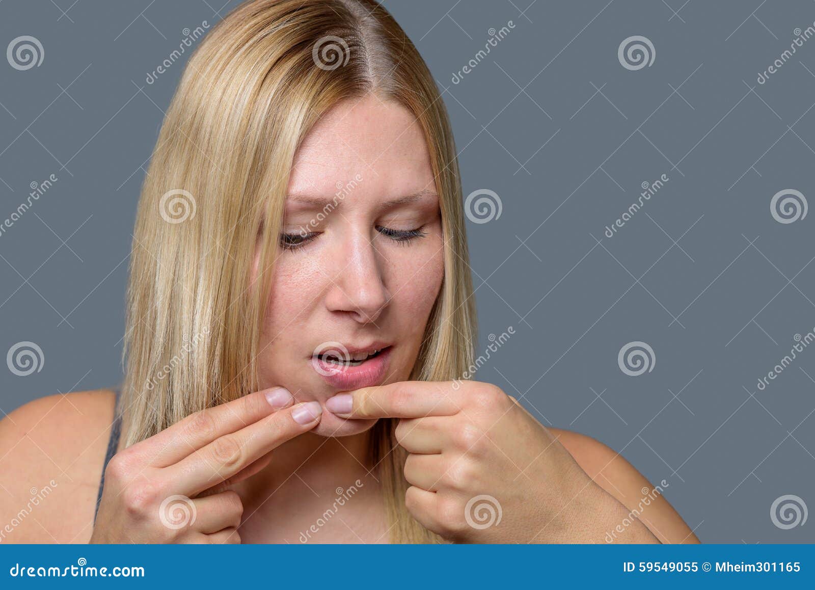 Mulher Que Espreme Uma Espinha Em Seu Queixo Imagem de Stock - Imagem ...