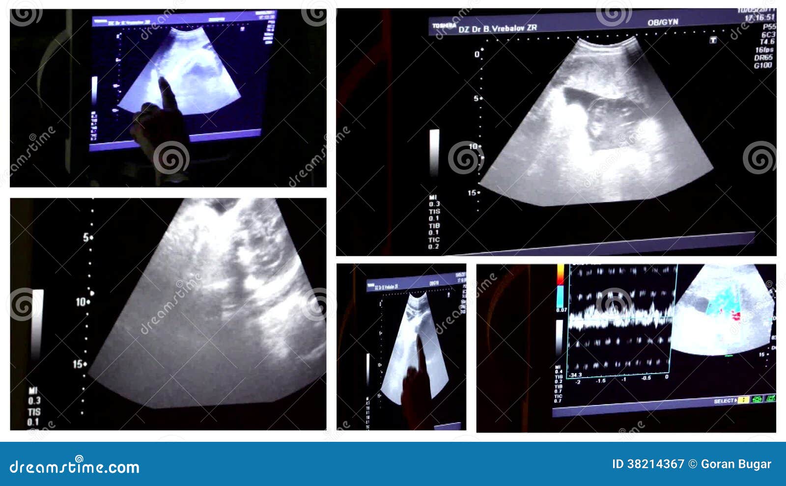 Multi Screen Ultrasound Baby in Mother S Womb Stock Video - Video of ...
