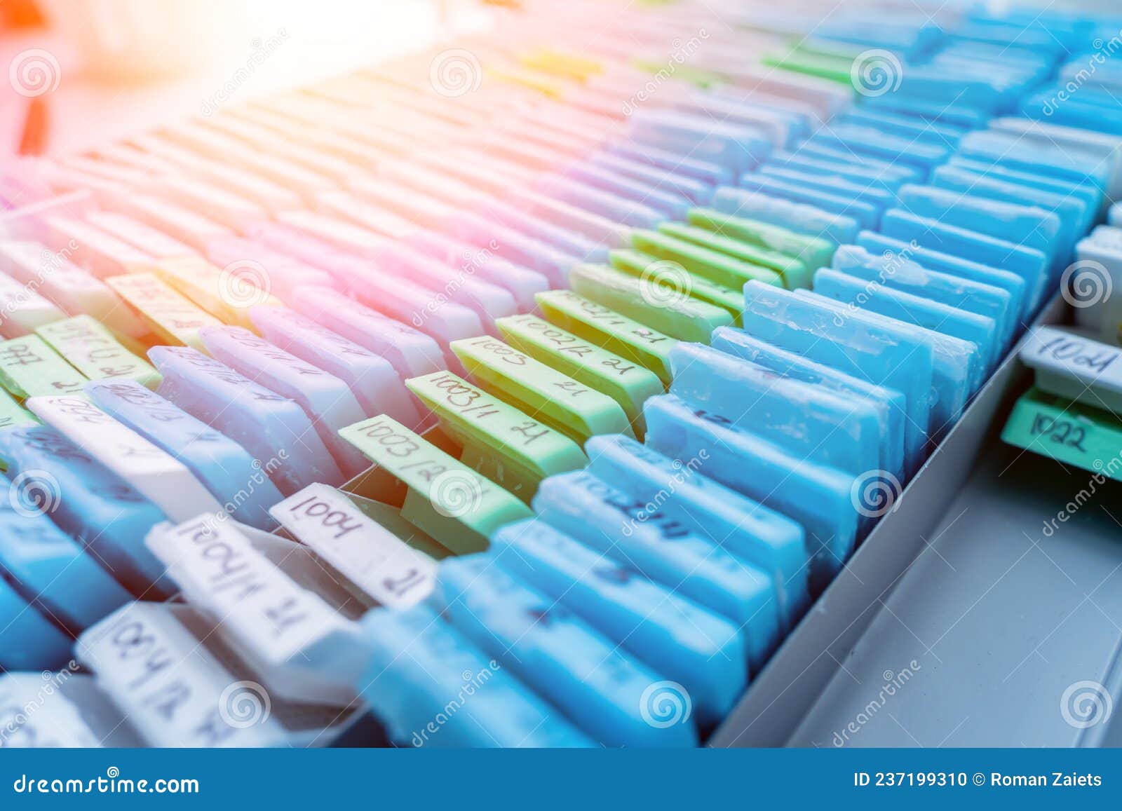 Multicolored Patient Tissue Blocks at Modern Laboratory Stock Photo ...
