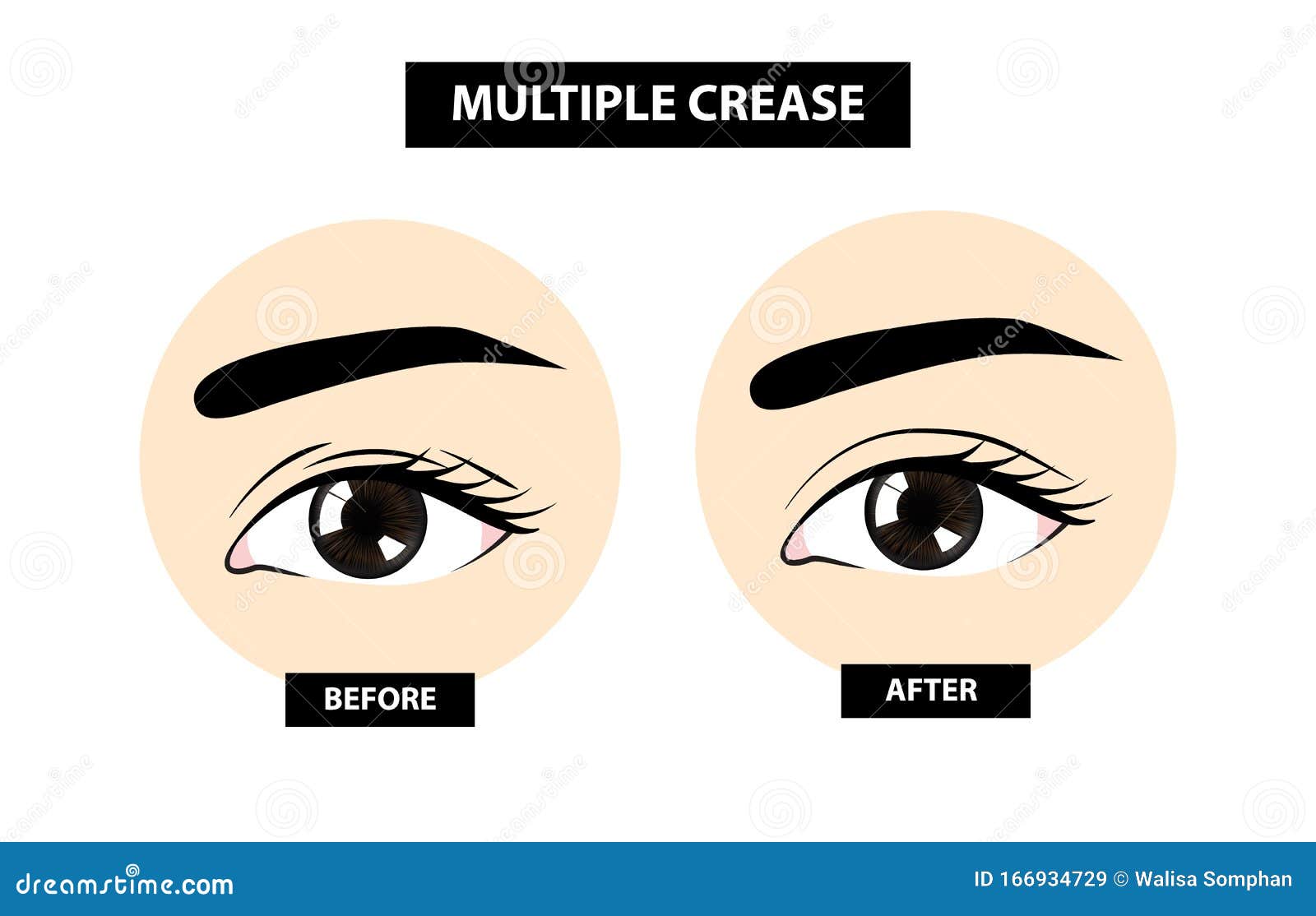 Multiple crease of eyelid stock vector. Illustration of lift - 166934729