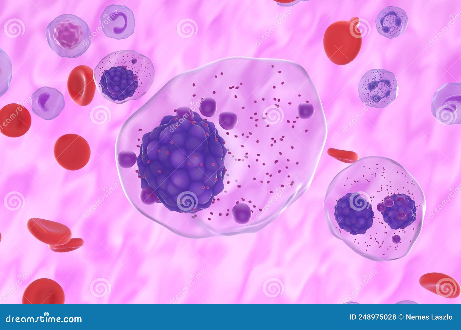 Multiple Myeloma Cells in the Blood Flow - Closeup View 3d Illustration ... Multiple Myeloma Cells in the Blood Flow - Closeup View 3d Illustration ...