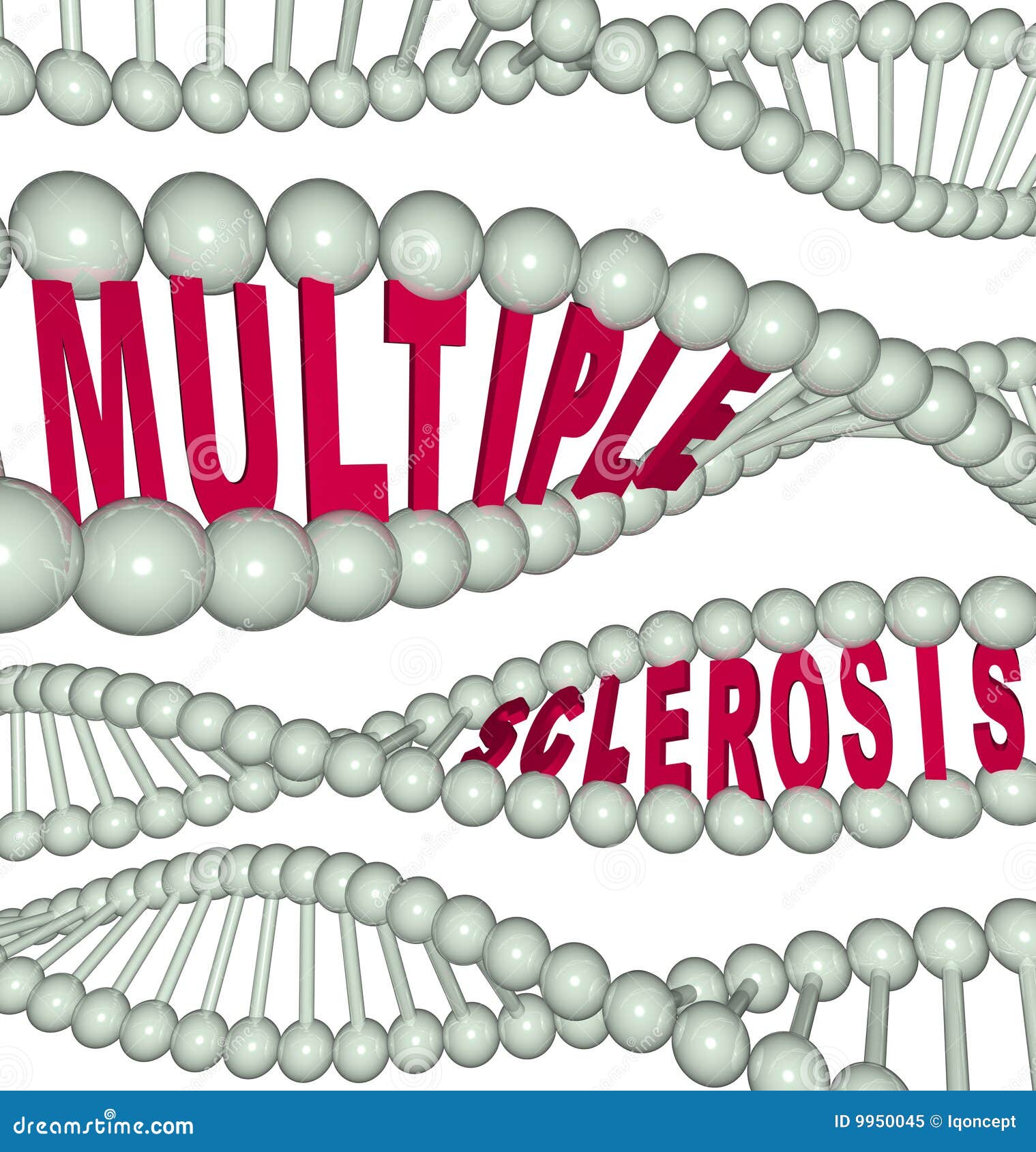 Multiple Sclerosis Demyelination Compared With Healthy Nerves Outline ...
