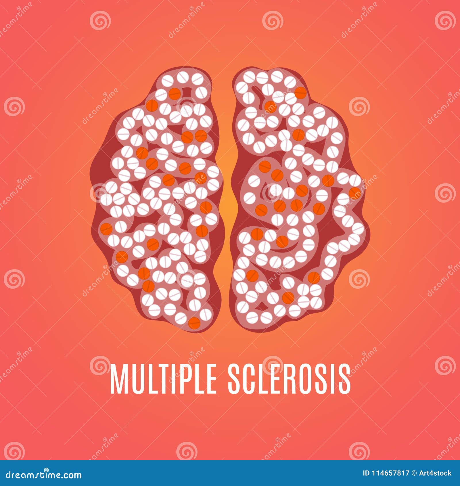 Multiple Sclerosis Poster with Brain Stock Vector - Illustration of ...