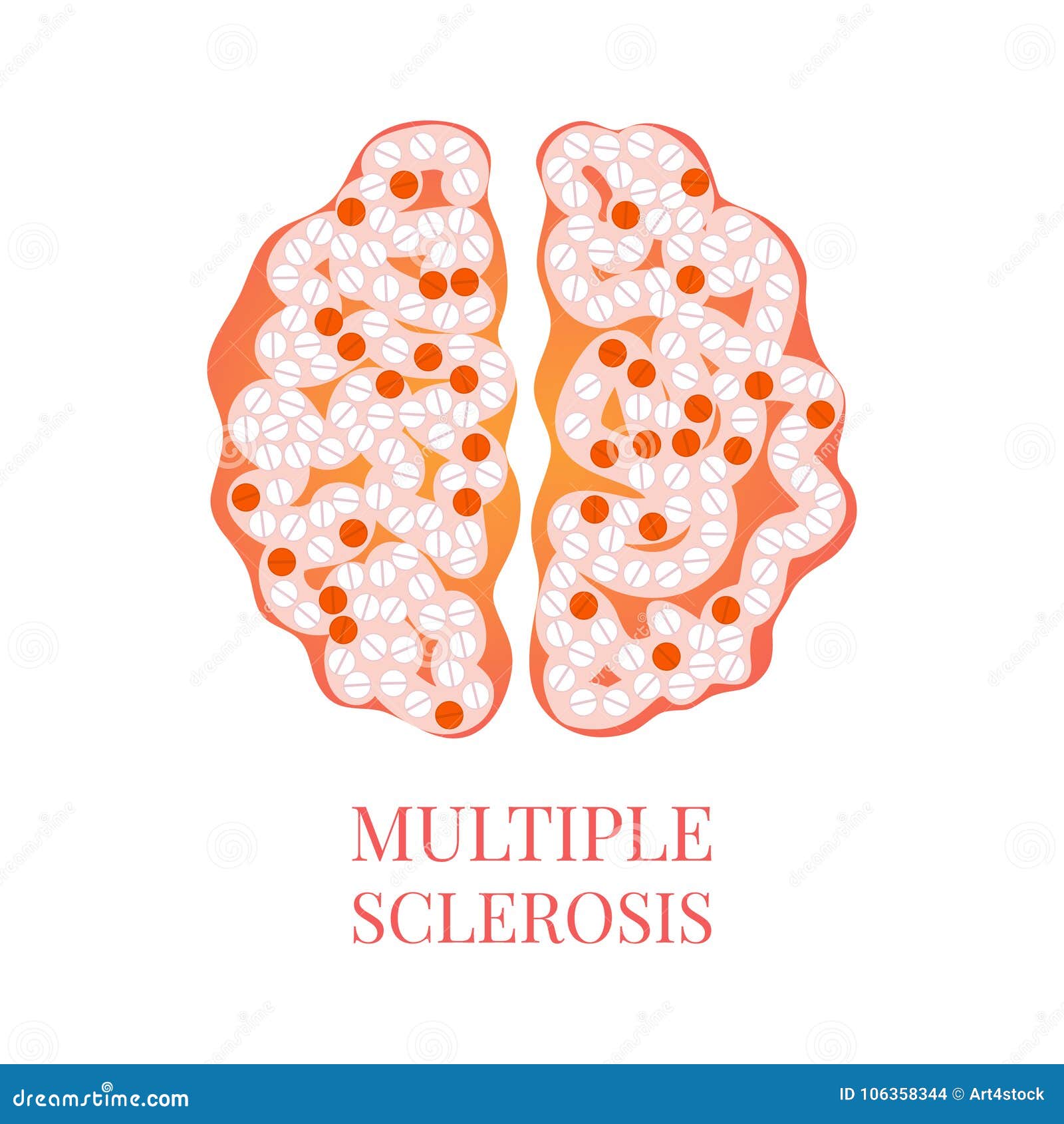 Multiple Sclerosis Poster with Brain Stock Vector - Illustration of ... Multiple Sclerosis Poster with Brain Stock Vector - Illustration of ...