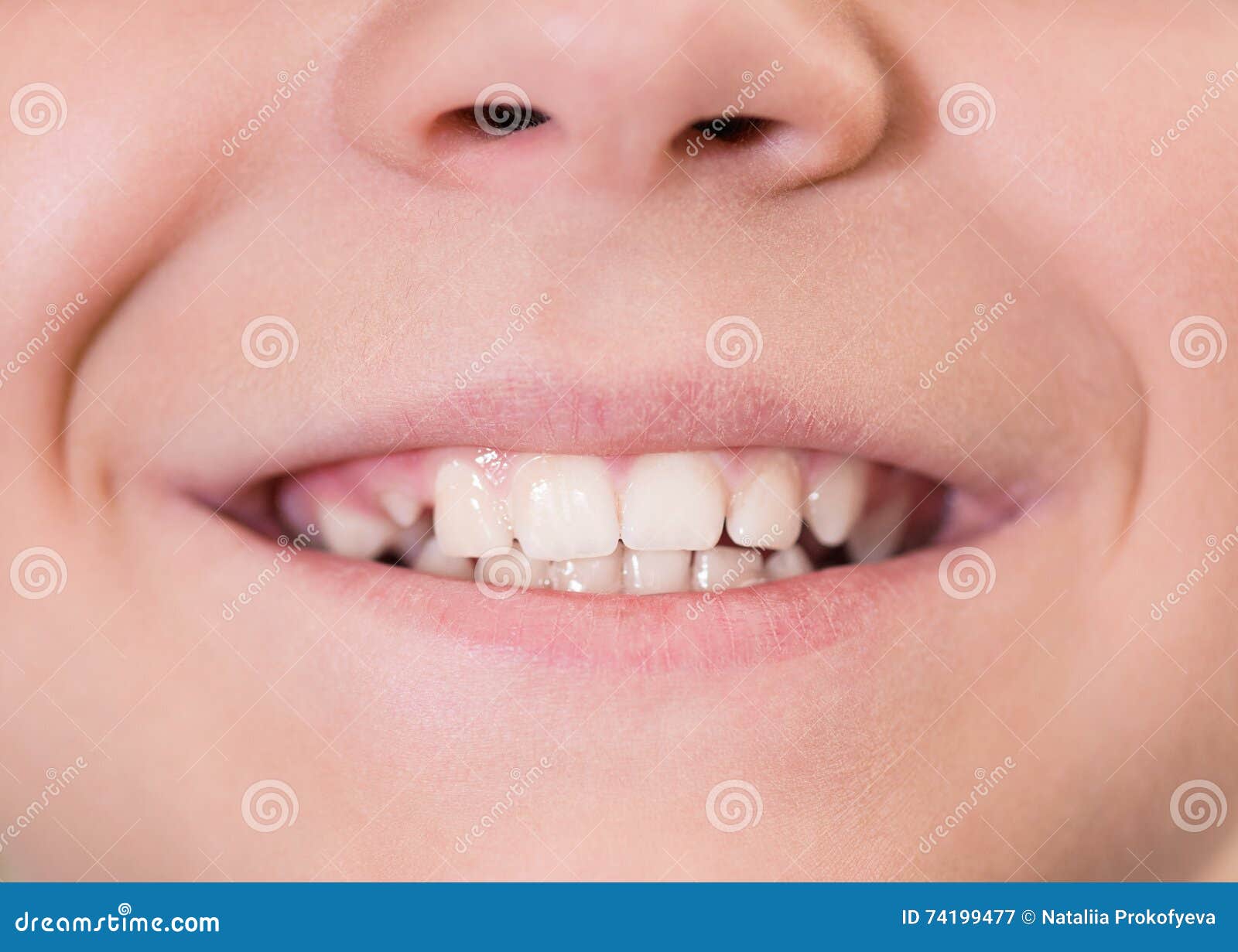 Mun med vita tänder fotografering för bildbyråer. Bild av förlust ...