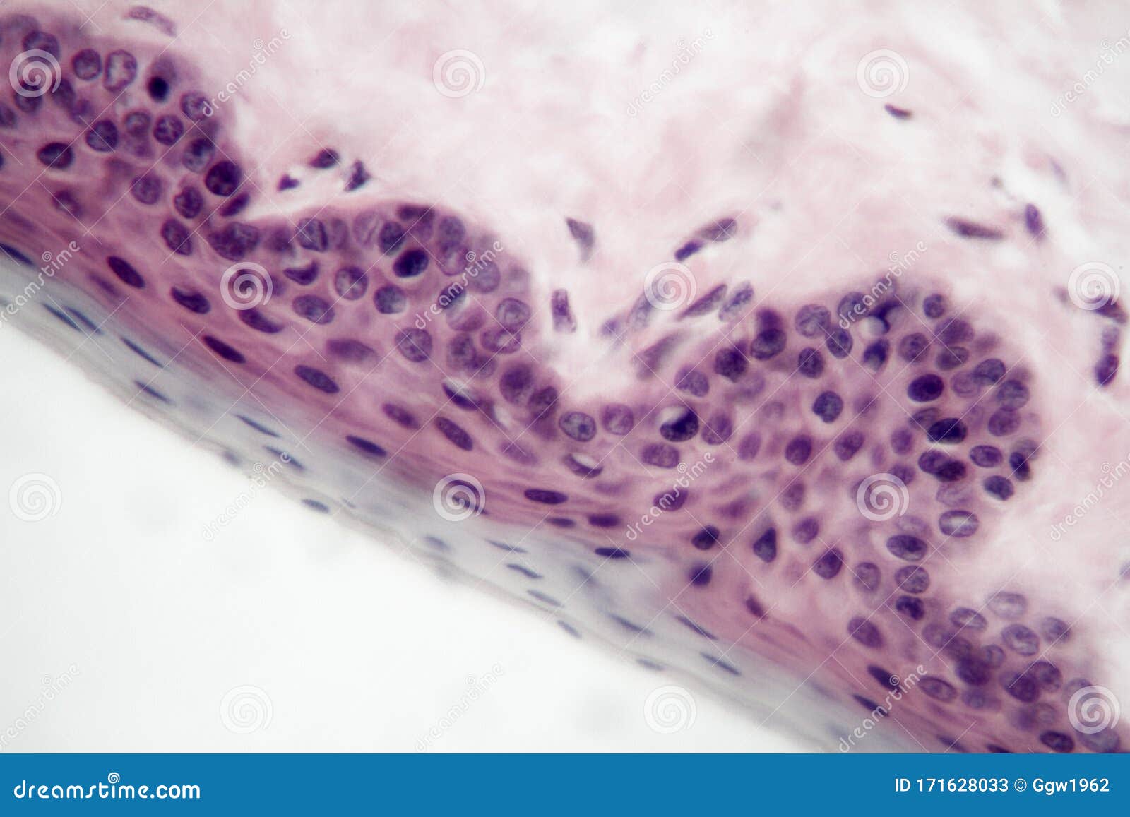 Muscle composite stock image. Image of generalized, laboratory - 171628033
