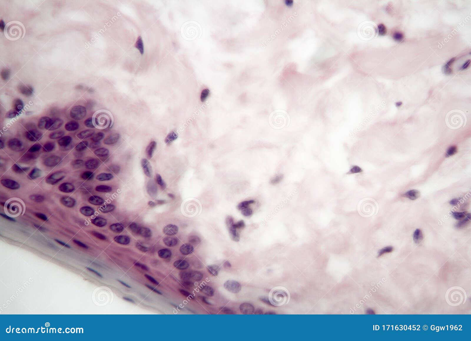 Muscle composite stock photo. Image of anatomy, experiment - 171630452