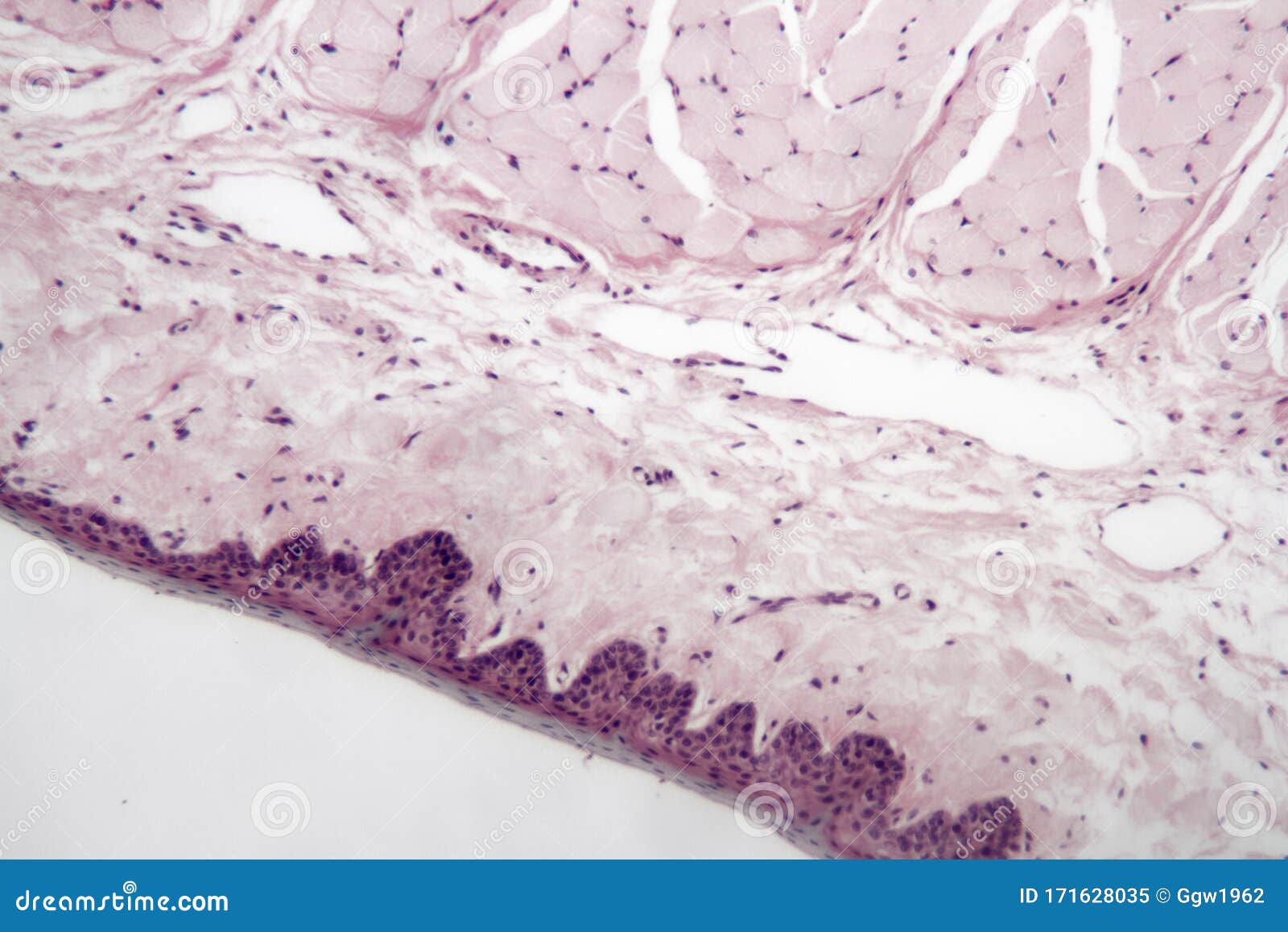 Muscle composite stock image. Image of biochemistry - 171628035