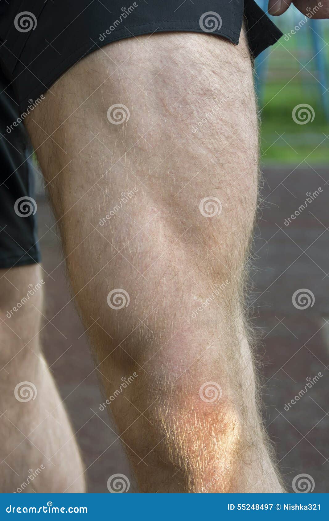Muscle leg stock image. Image of athletic, healthy, athlete - 55248497