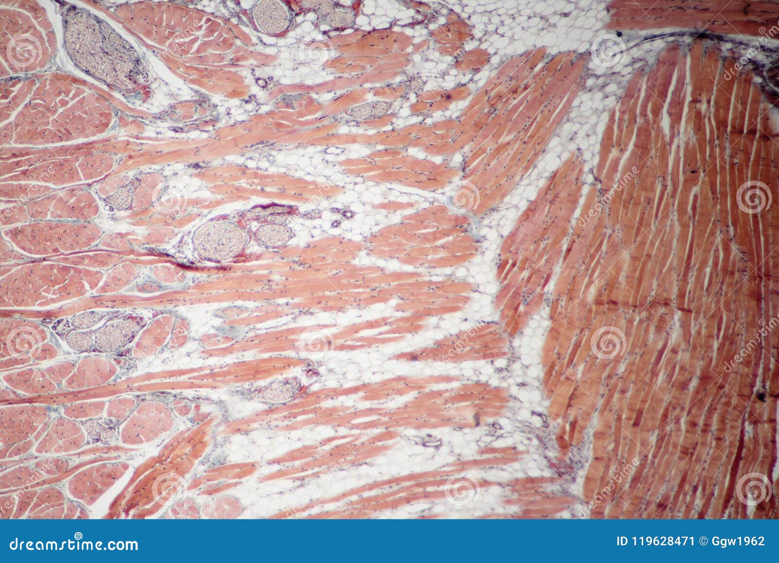 Muscle tissue stock image. Image of biopsy, view, university - 119628471