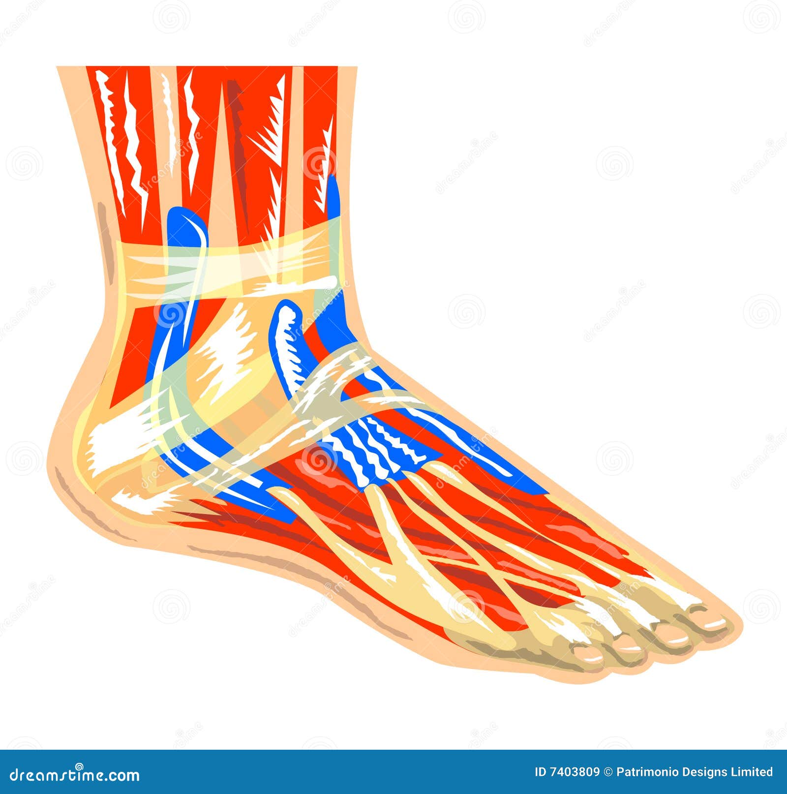 Peroneal Tendon Injuries_Peroneal Tendon Dislocation Vector ...