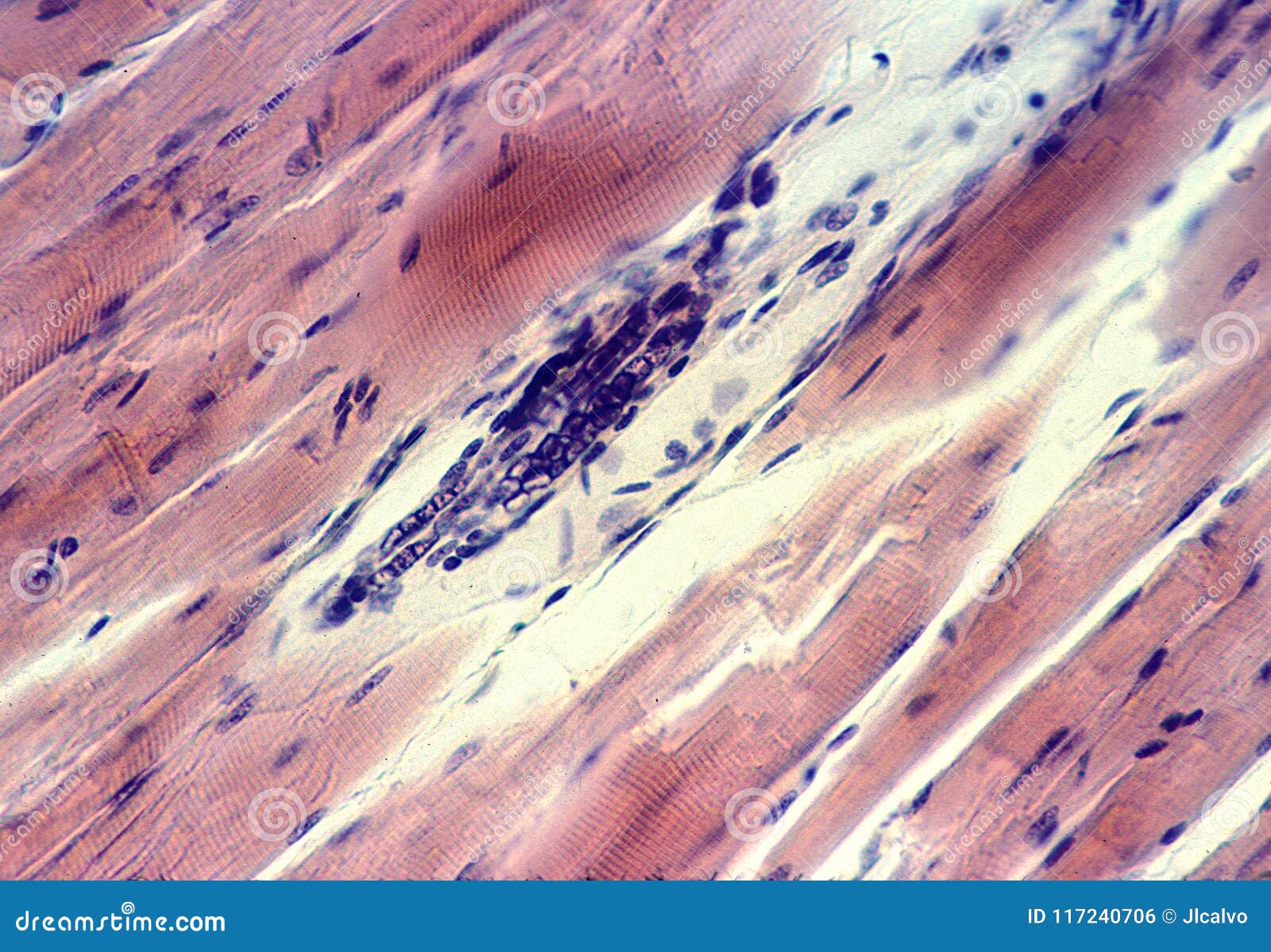 Muskelspindel stockfoto. Bild von system, mikroskopisch - 117240706