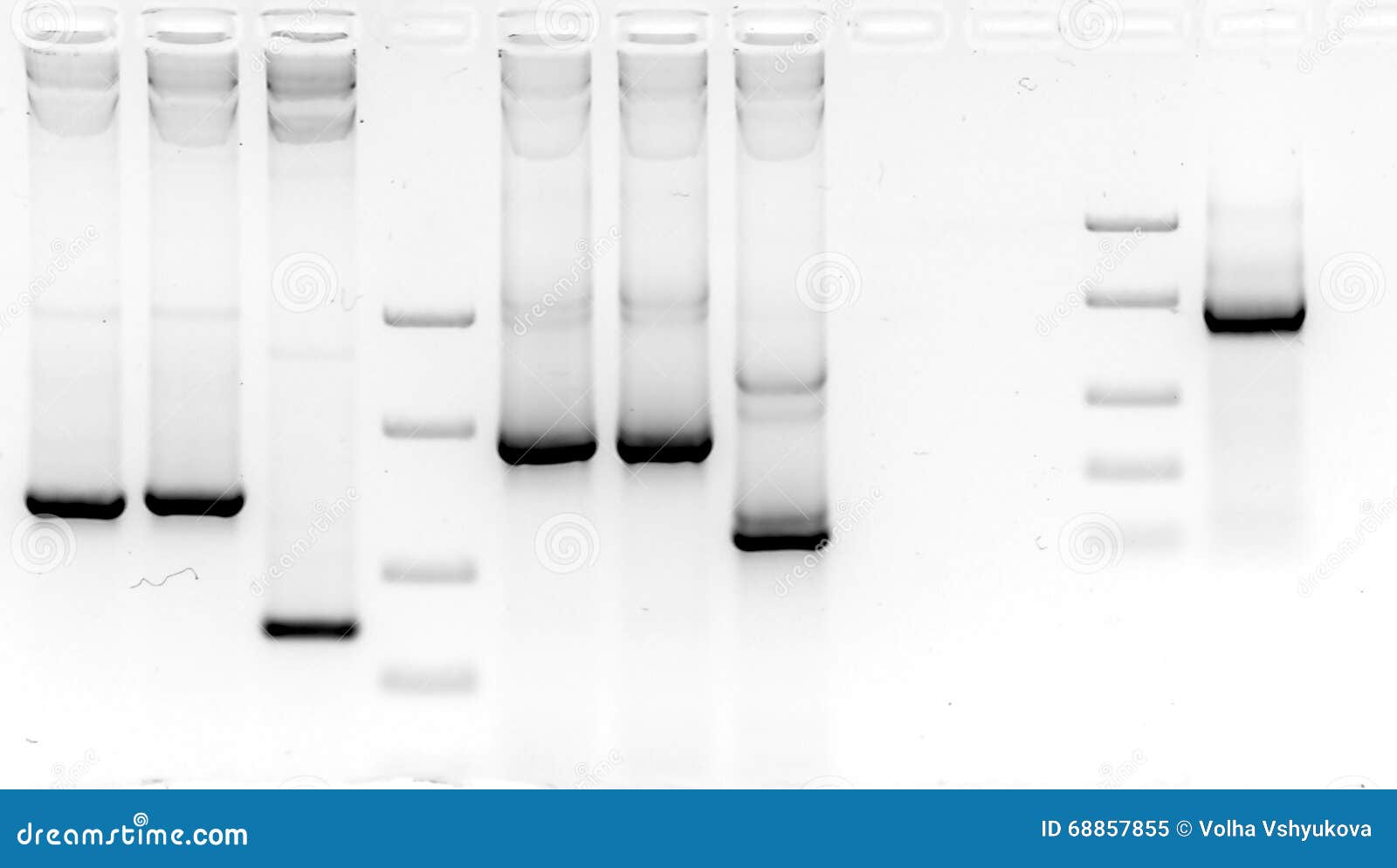 Mutation Screening in Agarose Gel Stock Image - Image of molecular ...
