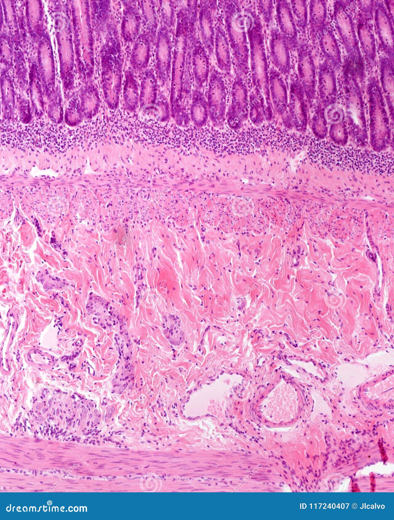 Muur van de dunne darm stock afbeelding. Afbeelding bestaande uit ...