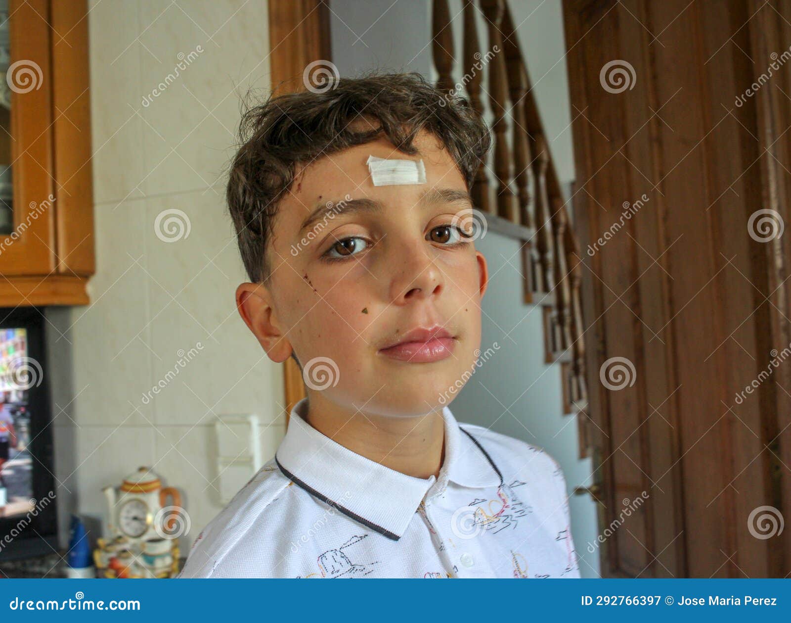 My Son with Bruises in His Face Stock Image - Image of male, bruise ...
