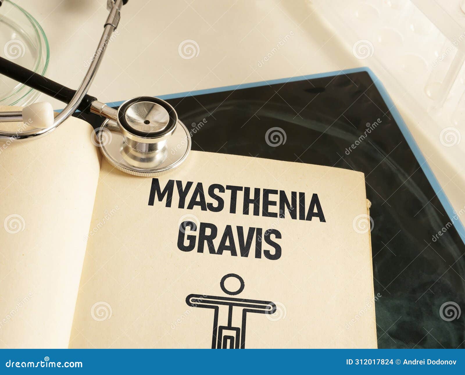 Myasthenia Gravis is Shown Using the Text Stock Photo - Image of ...
