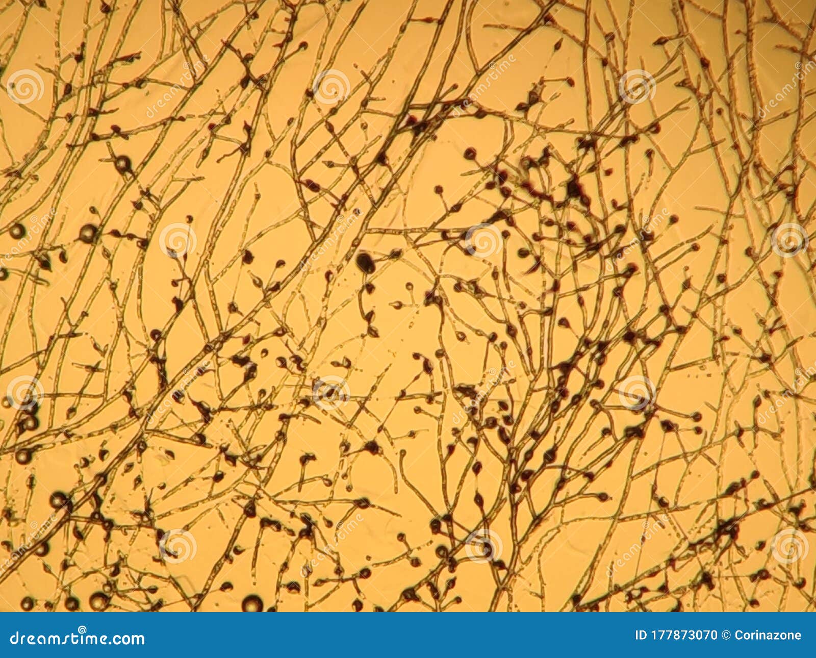 Dermatophyte Fungus Isolated From Human Skin Under The Microscope ...