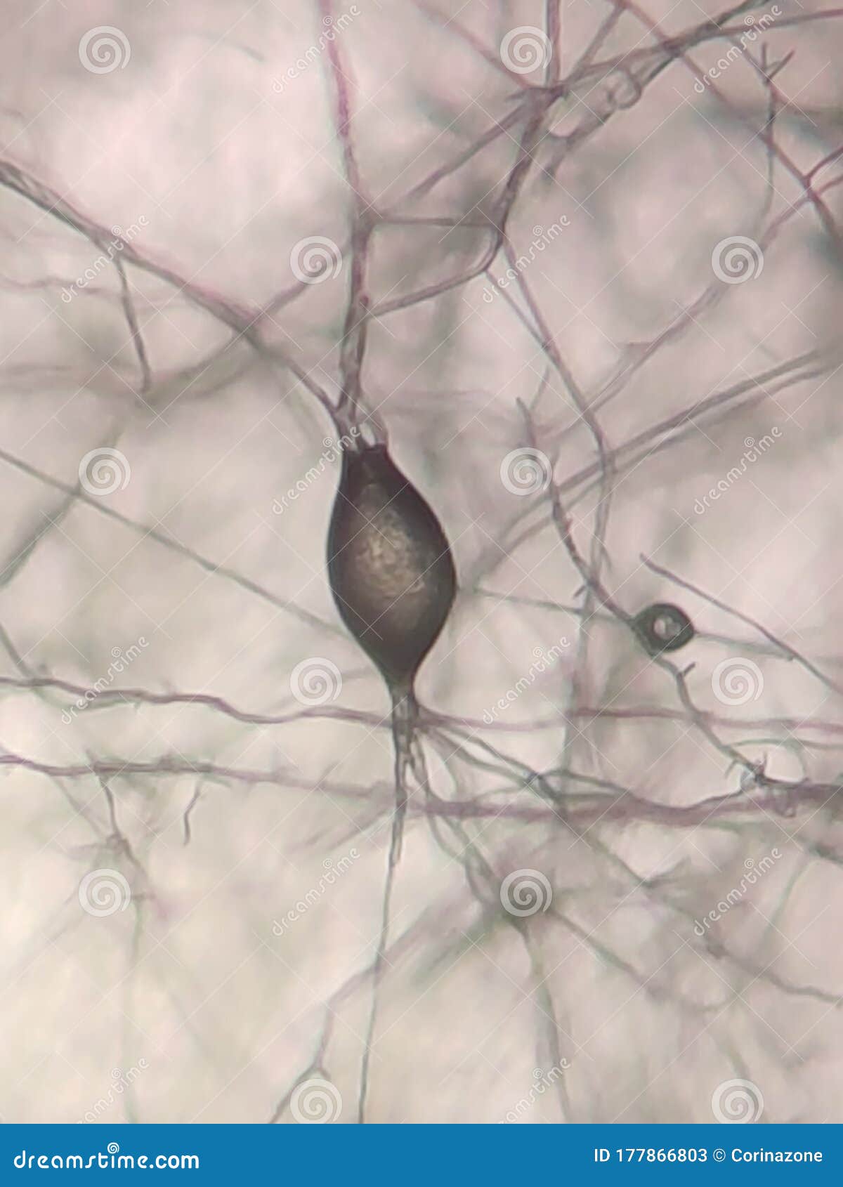 The Mycelium of a Dermatophyte Fungus Under the Microscope Stock Image ...