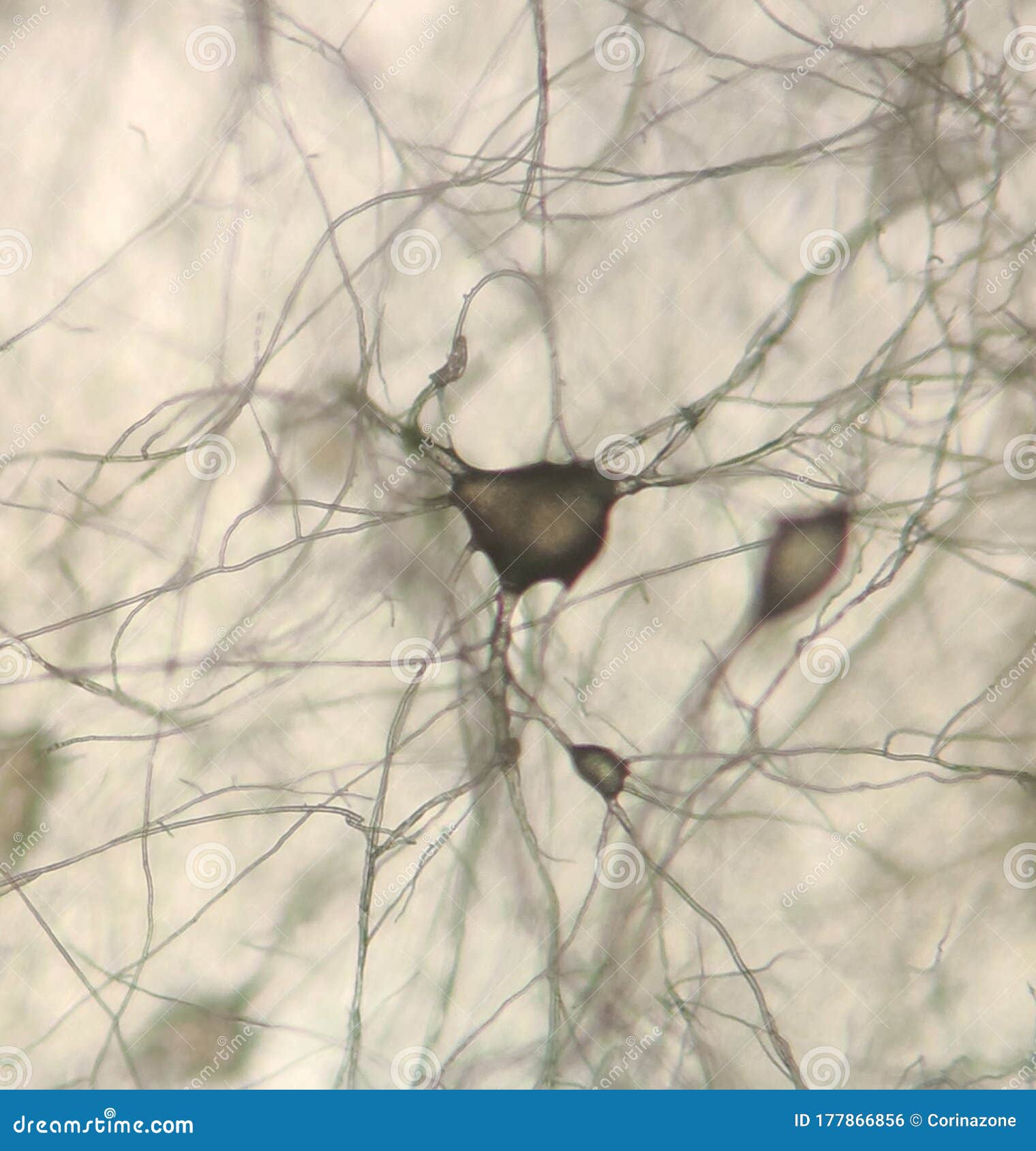 The Mycelium of a Dermatophyte Fungus Under the Microscope Stock Photo ...