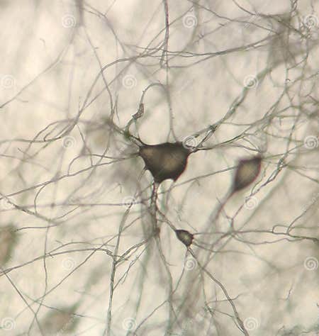 The Mycelium of a Dermatophyte Fungus Under the Microscope Stock Photo ...