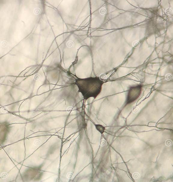 The Mycelium of a Dermatophyte Fungus Under the Microscope Stock Photo ...