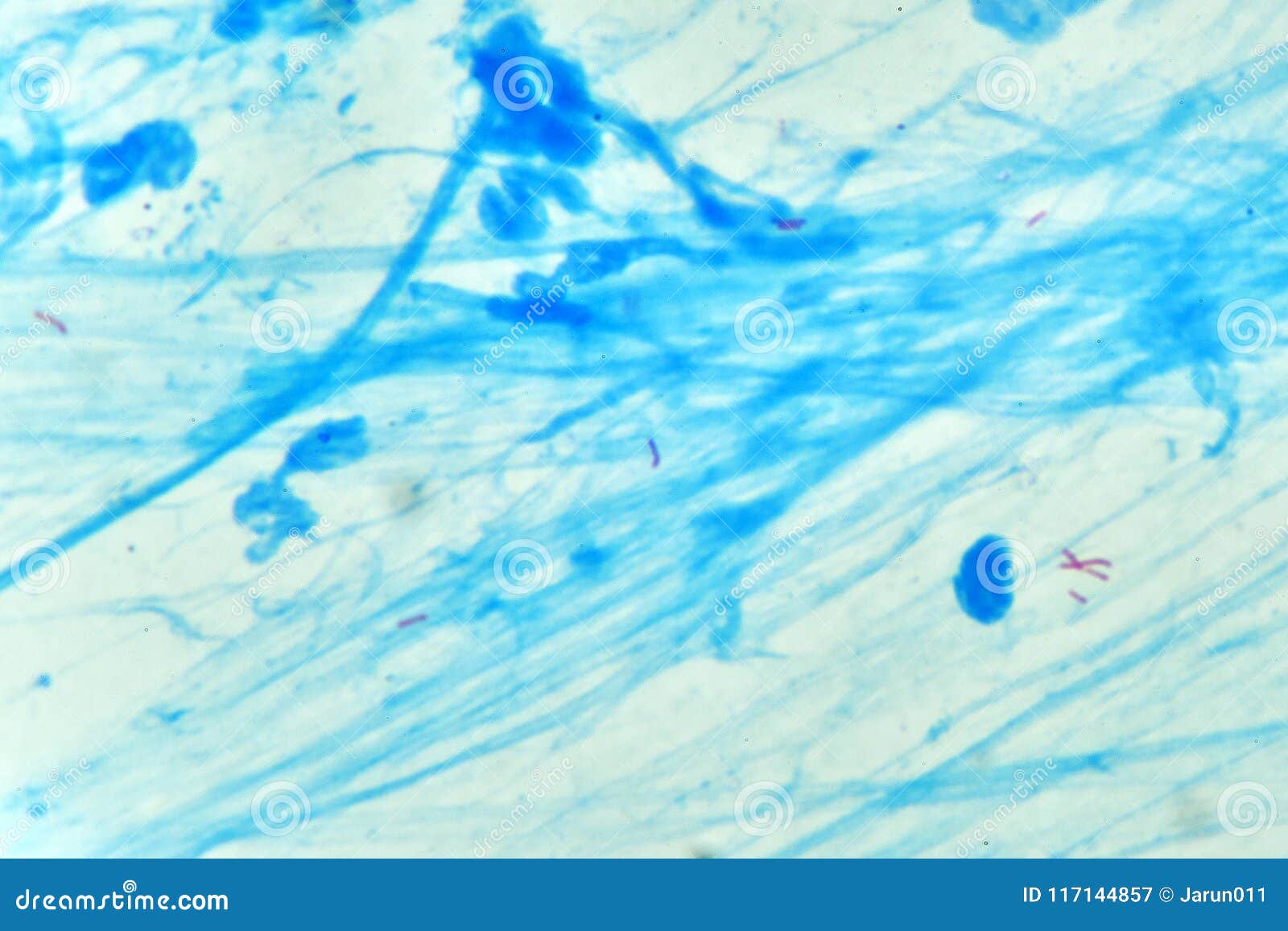 Acid Fast Bacilli In Culture Tubes With Mycobacterium Tuberculosis ...