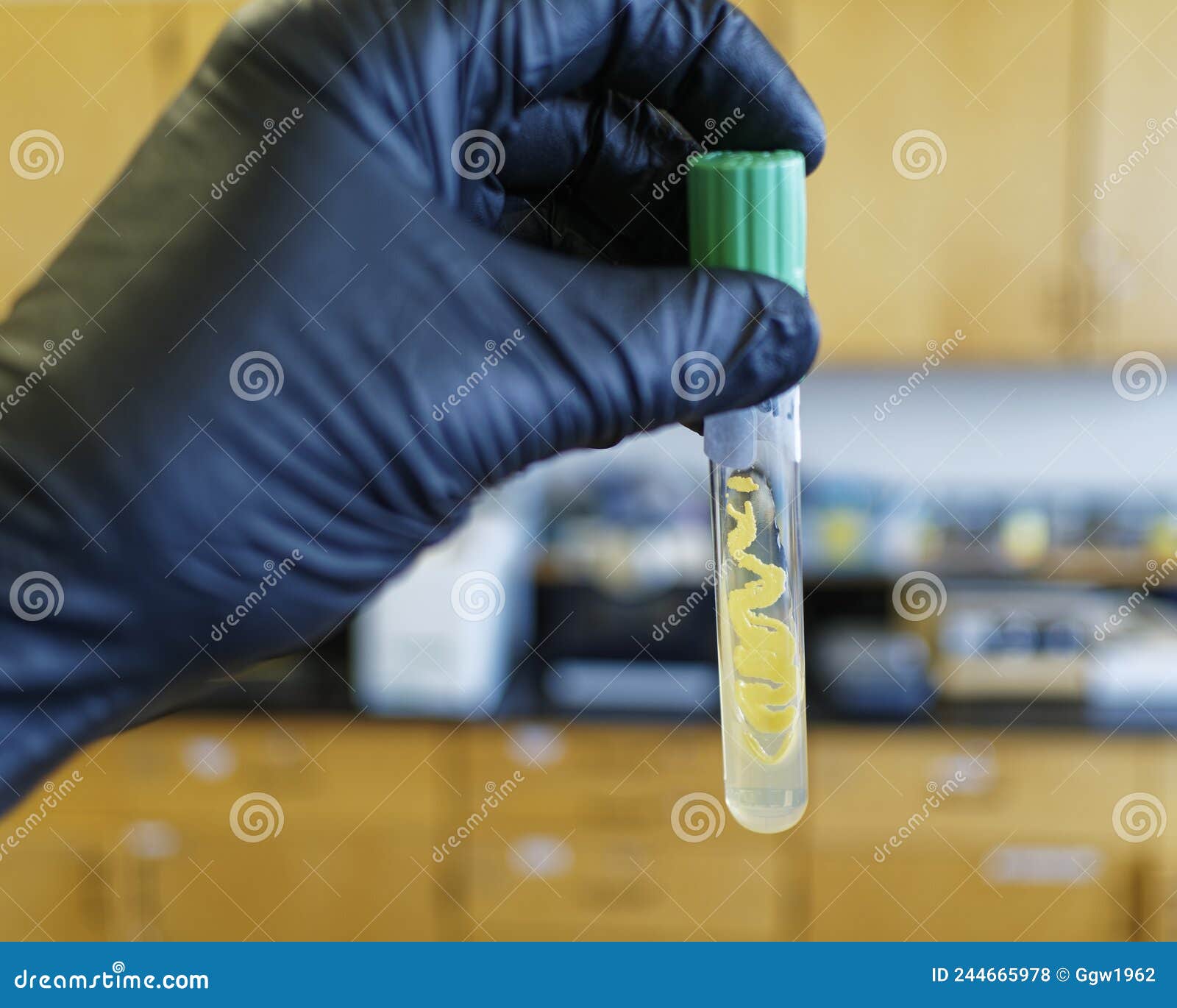 Mycobacterium smegmatis stock photo. Image of identification - 244665978