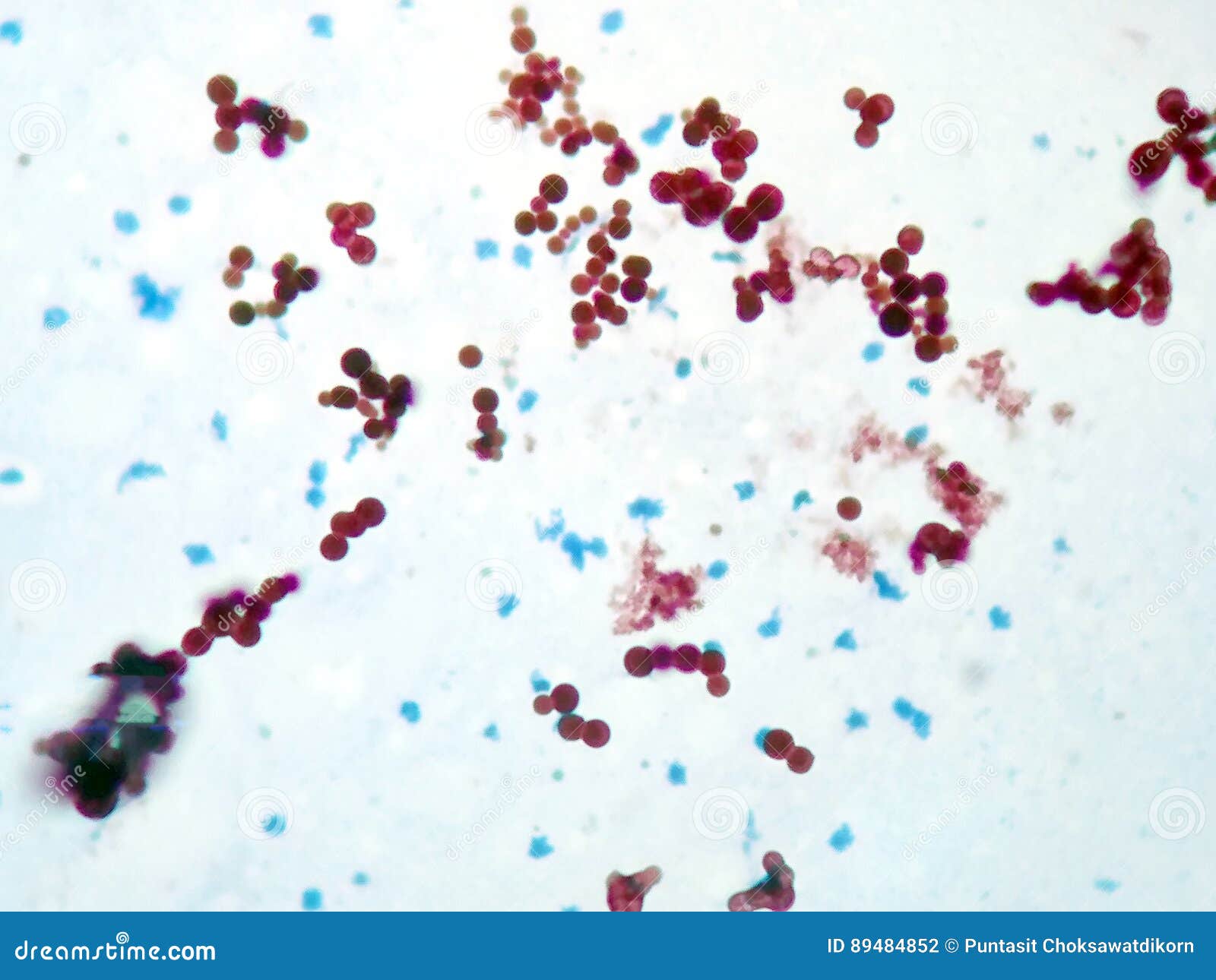 Mycobacterium stock photo. Image of enteric, medical - 89484852