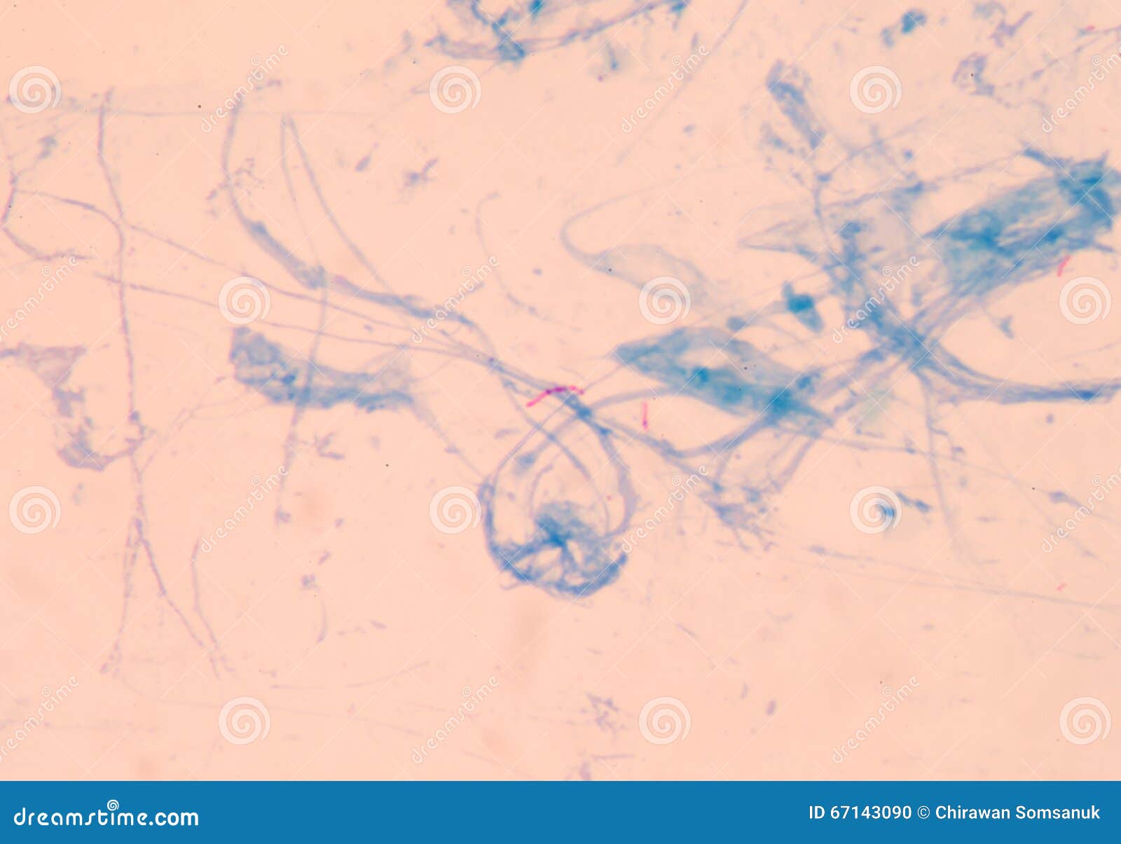 Mycobacterium Tuberculosis Red Cells. Stock Photo - Image of life ...