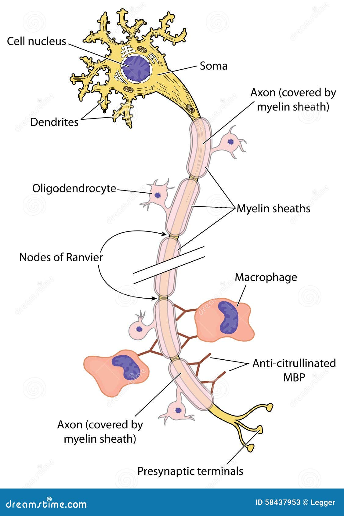 Myelinated Nerv I Multipel Sklero Vektor Illustrationer - Illustration ...