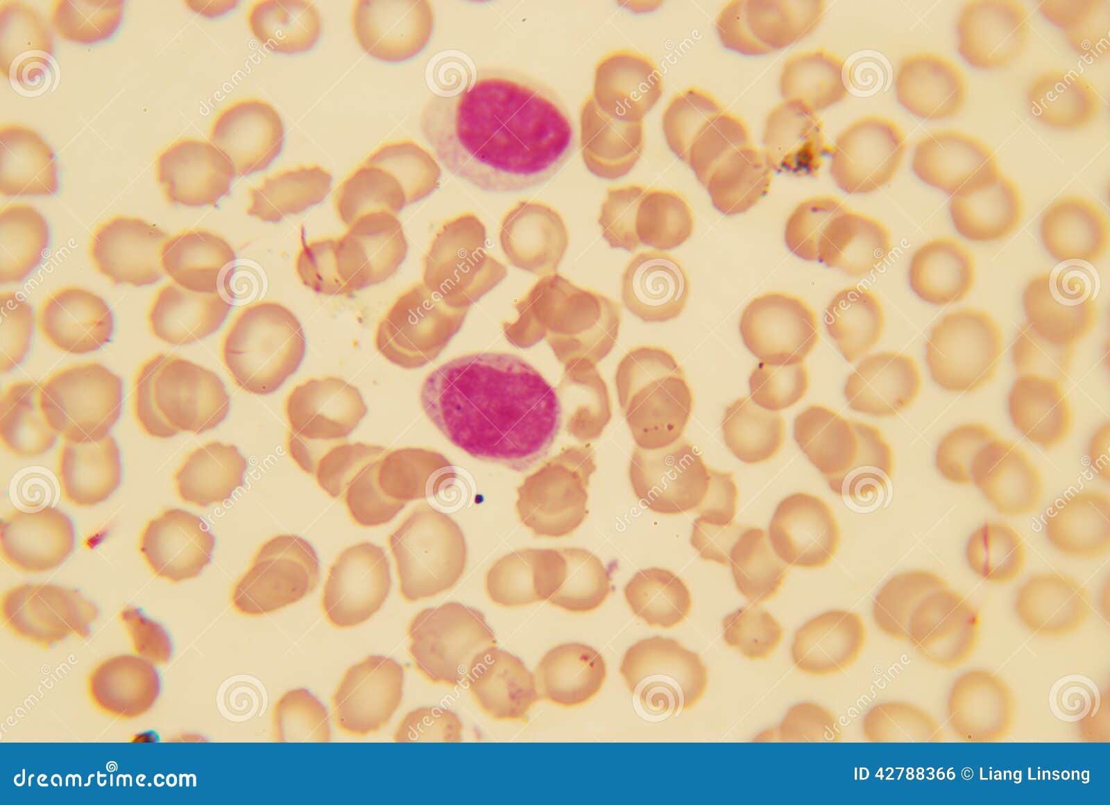 Myeloblast stock photo. Image of cells, neutrophil, white - 42788366