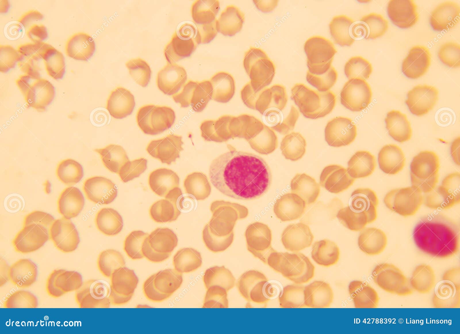 Myeloblast stock photo. Image of microscope, cell, health - 42788392