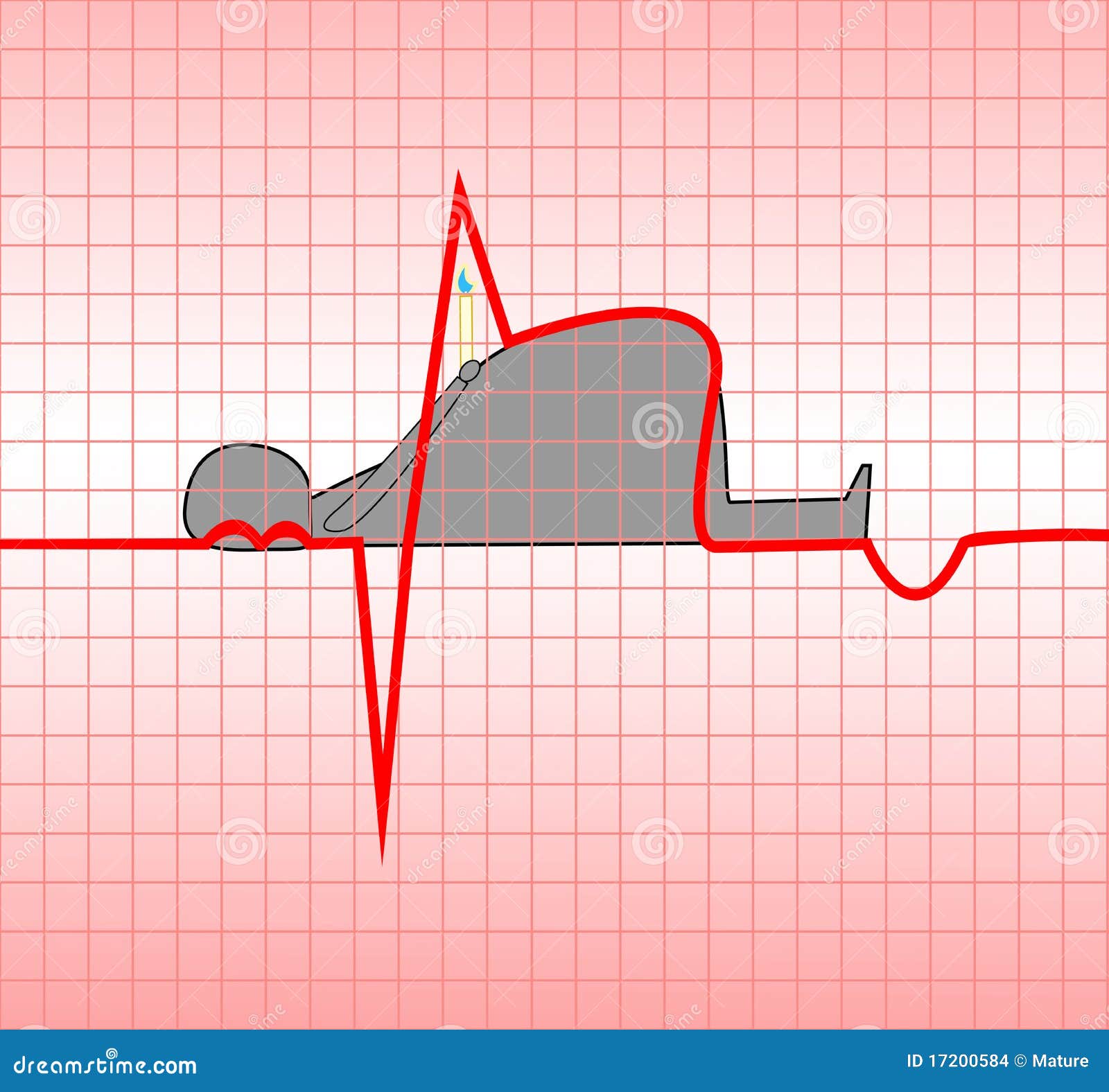 Myocardial infarction stock vector. Illustration of fire - 17200584