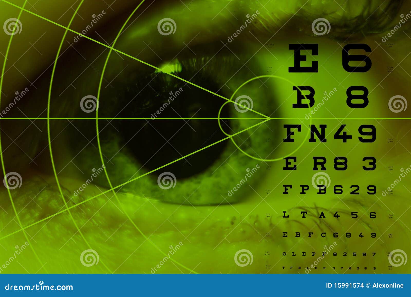 Myopia astigmatism stock photo. Image of surgery, surgeon - 15991574