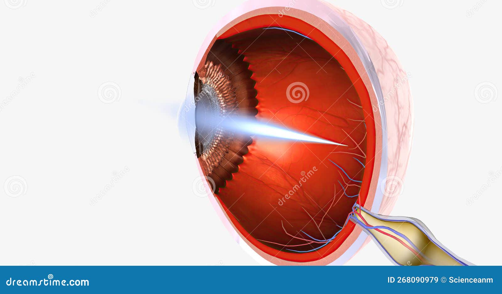 Myopia, is a Common Visual Condition in Which the Eye S Ability To ...