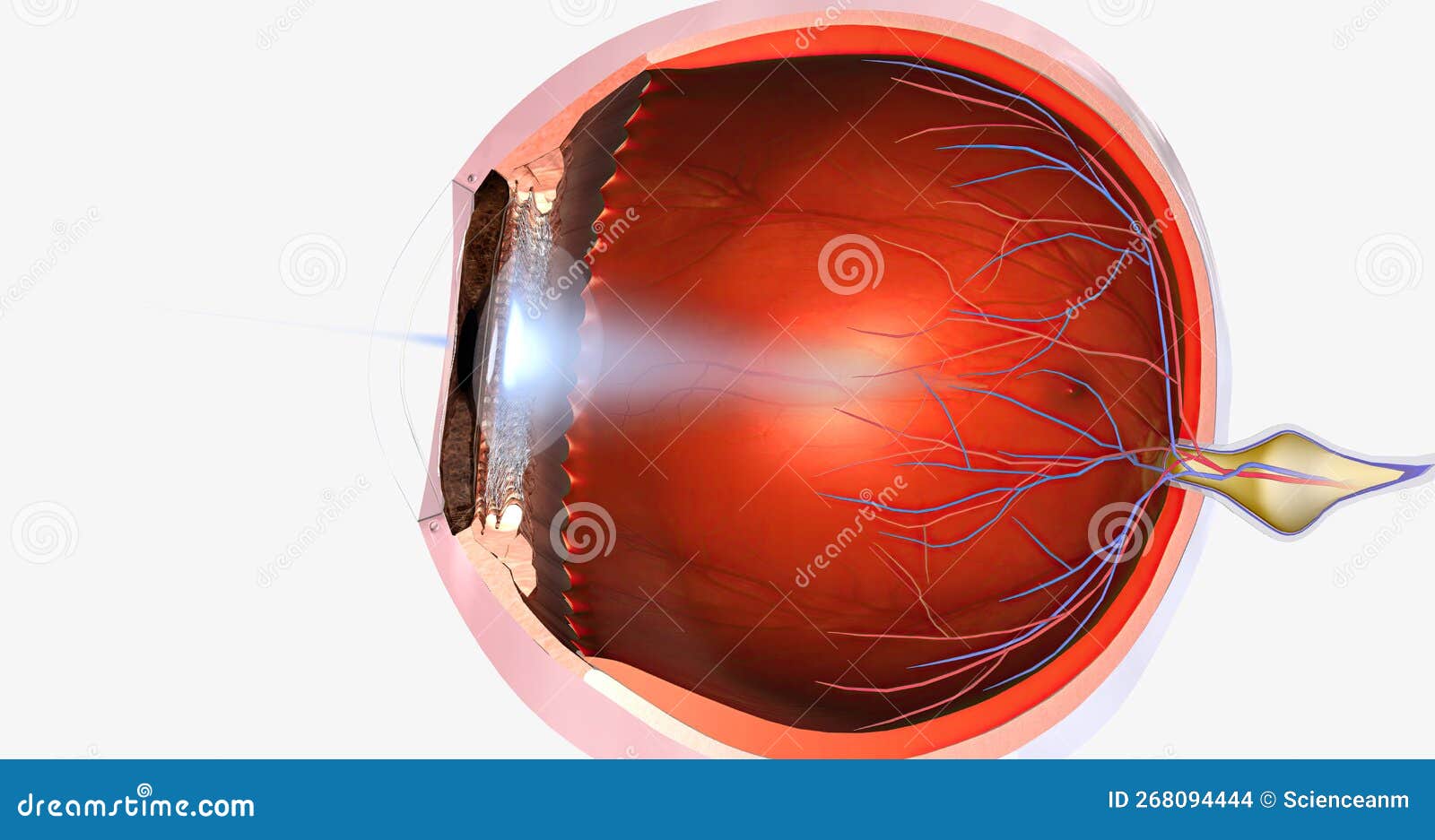 Myopia, is a Common Visual Condition in Which the Eye S Ability To ...